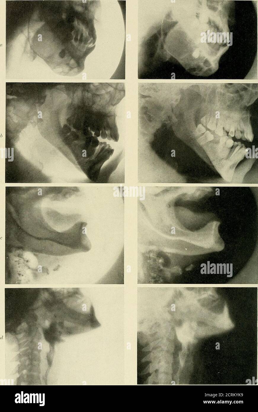 . Radiography, x-ray therapeutics and radium therapy . PLATE III ...