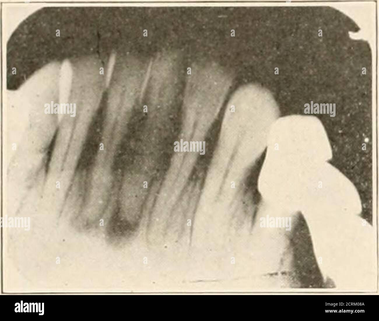 Rarefying hi-res stock photography and images - Alamy