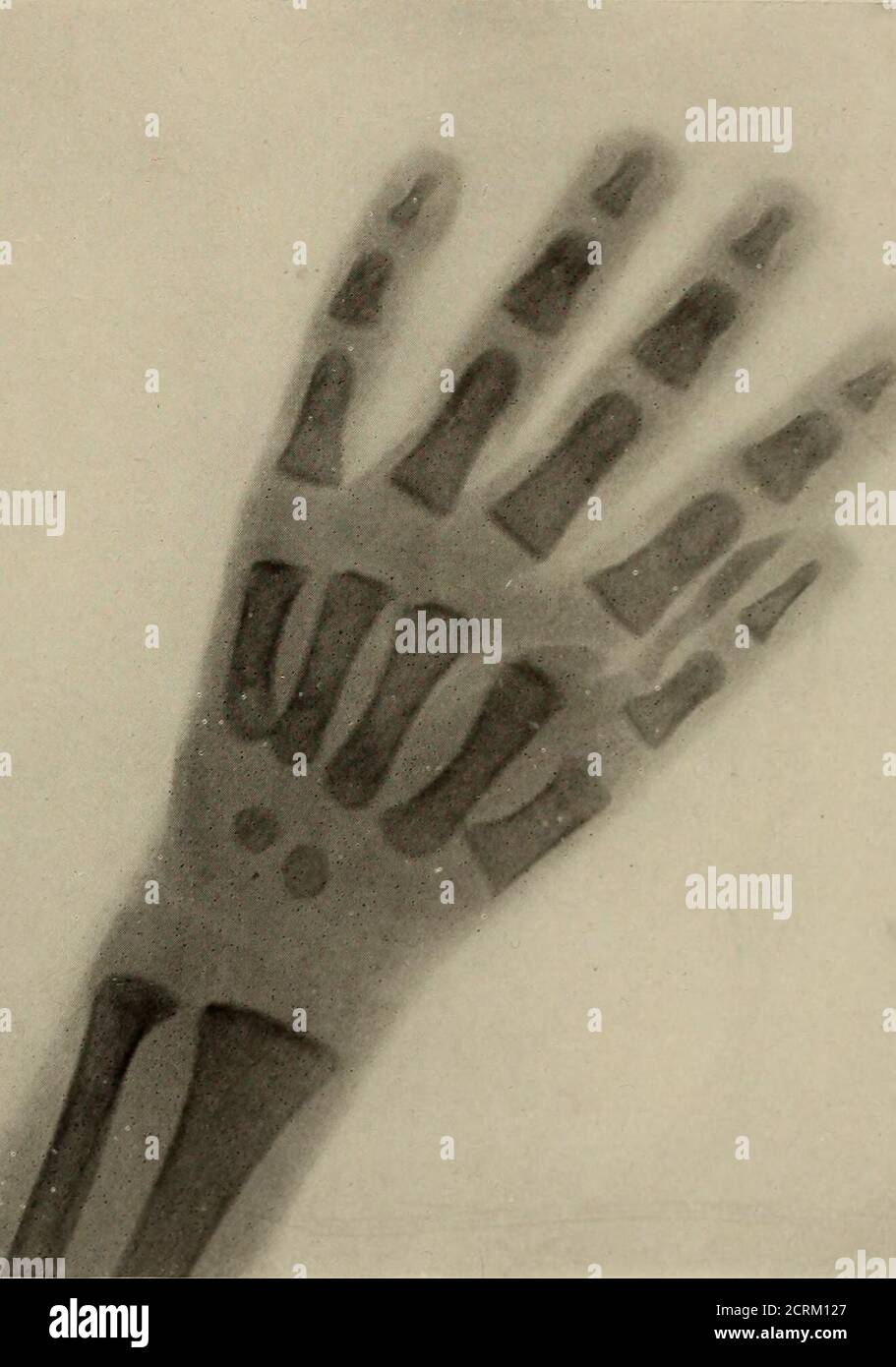 Unciform hi-res stock photography and images - Alamy