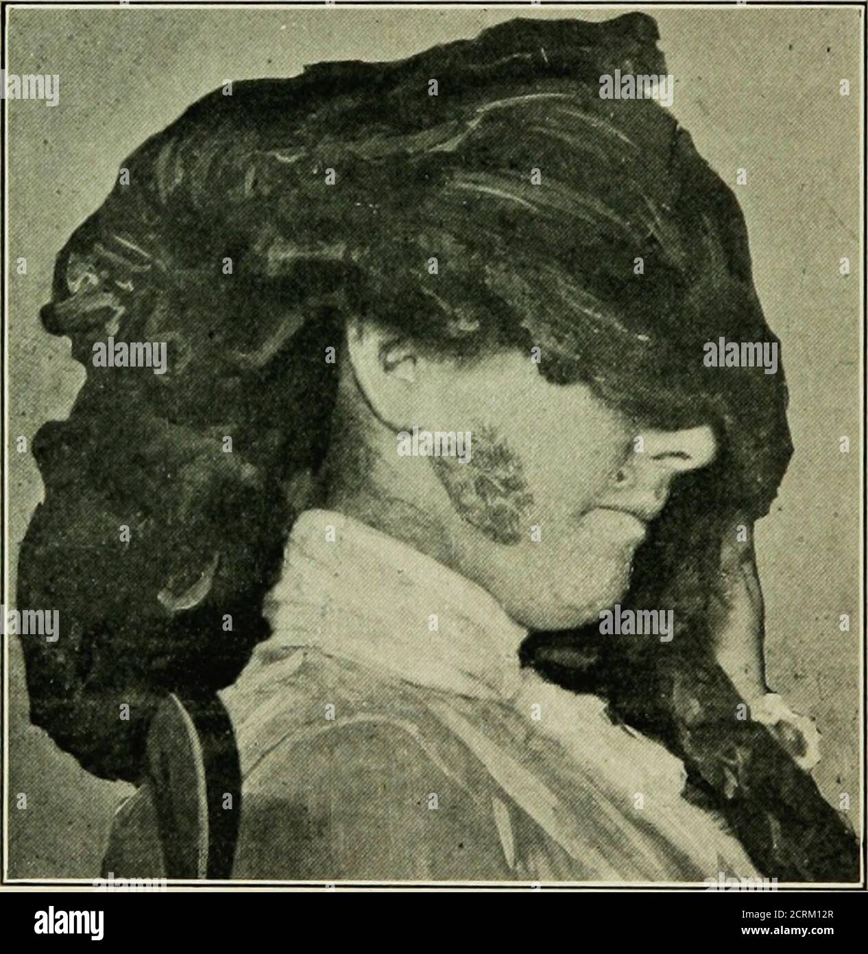 . A manual of electro-static modes of application, therapeutics ...