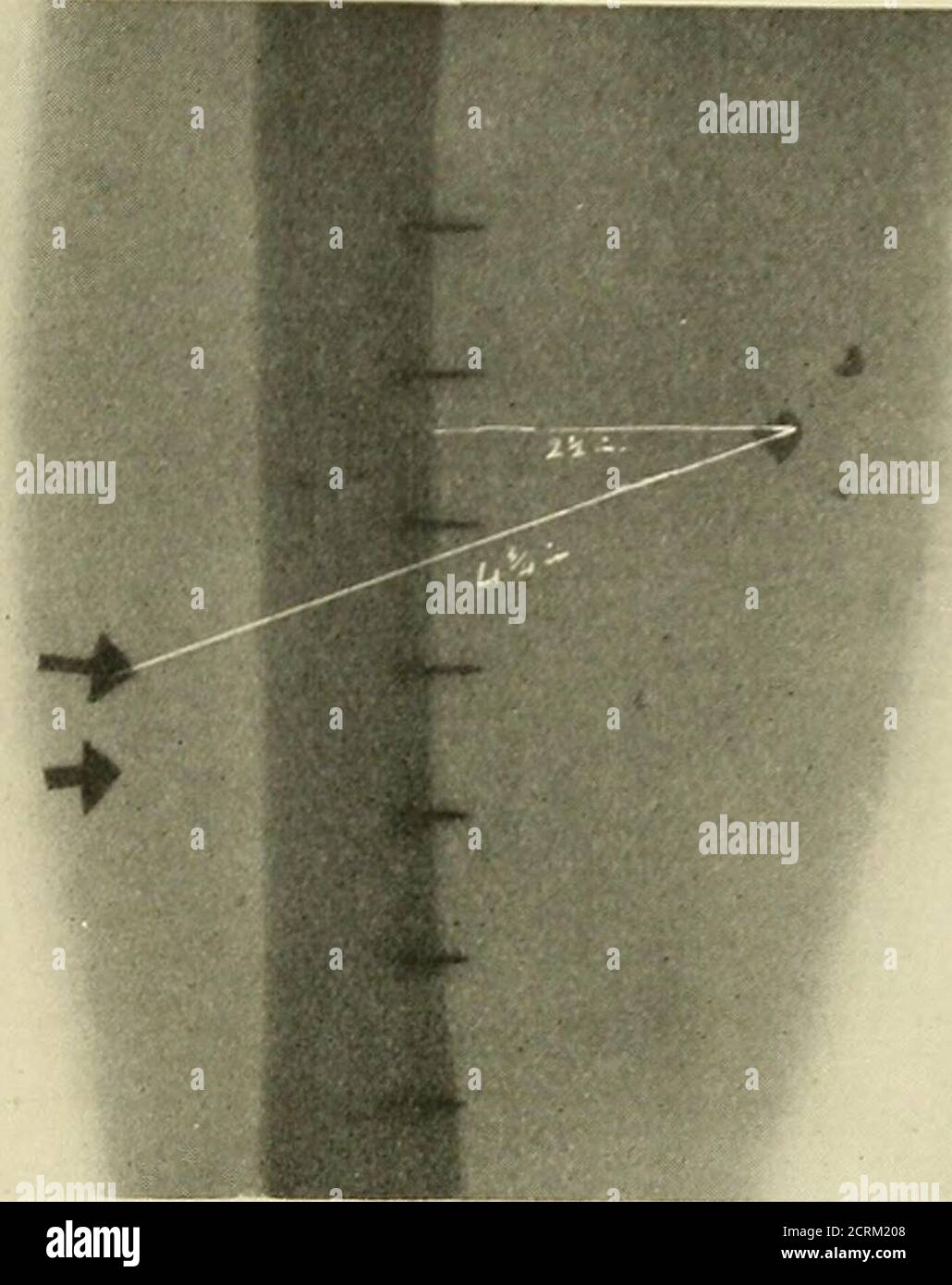 . Radiography, x-ray therapeutics and radium therapy . Fig. 100 ...