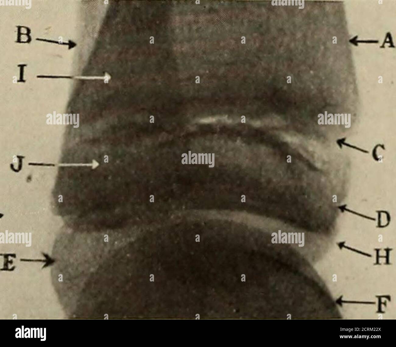 . Living anatomy and pathology; . FIG. 3. K— . FIG. 6 Stock Photo - Alamy