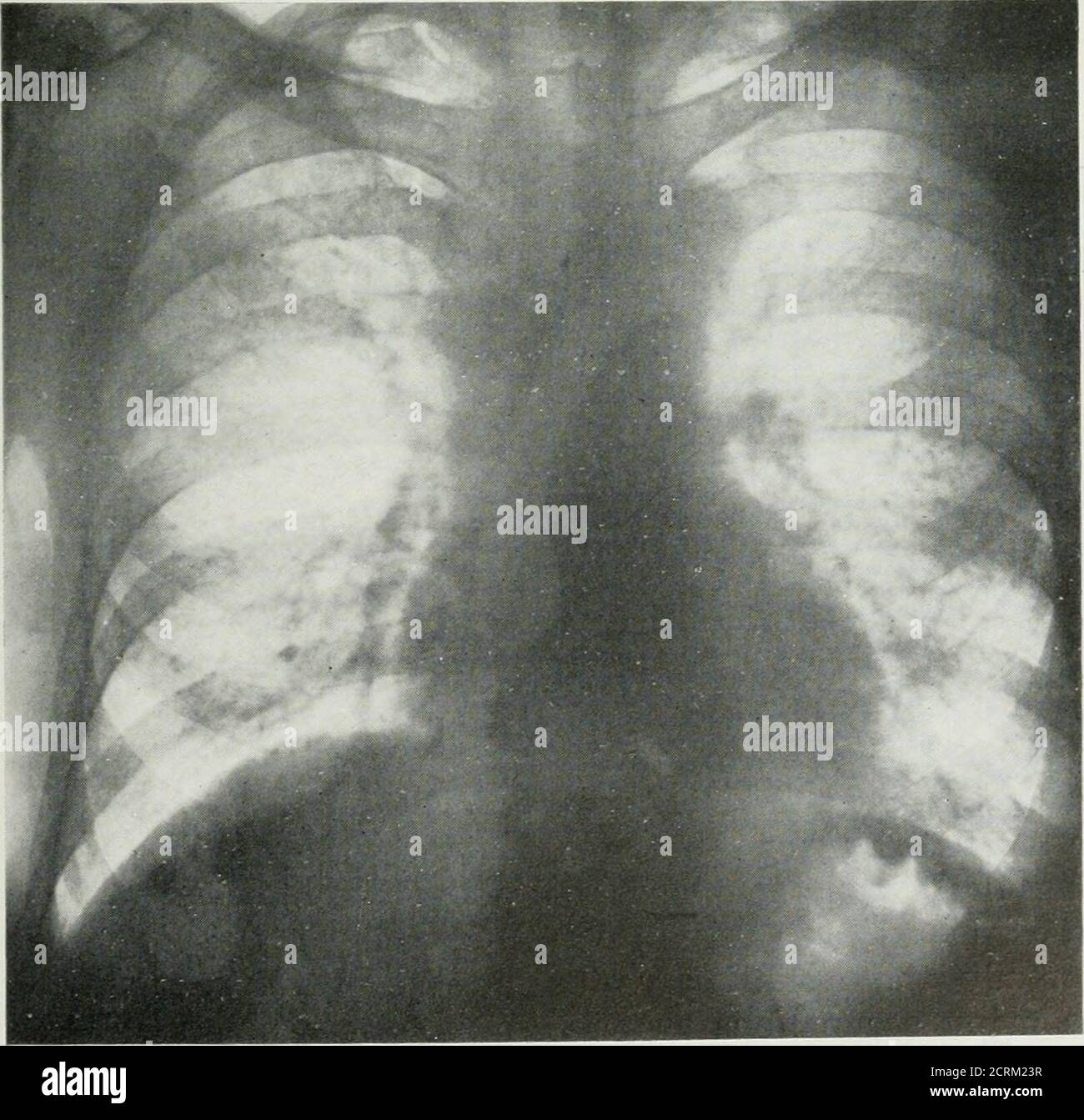 . The American journal of roentgenology, radium therapy and nuclear ...