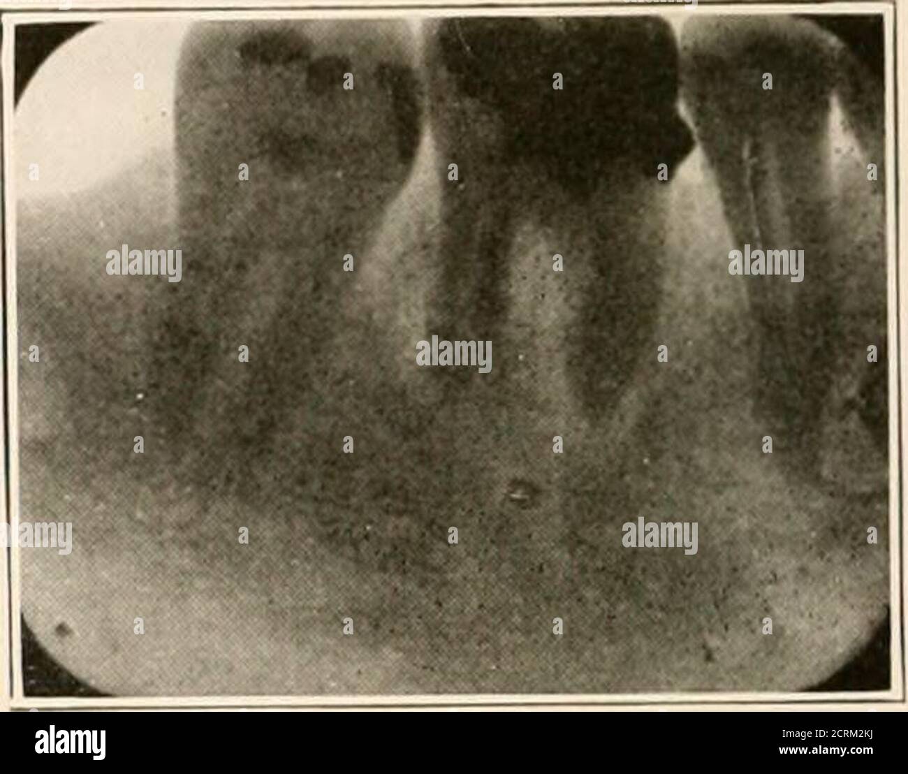 . Oral sepsis in its relationship to systemic disease . Fig. 168. Fig ...