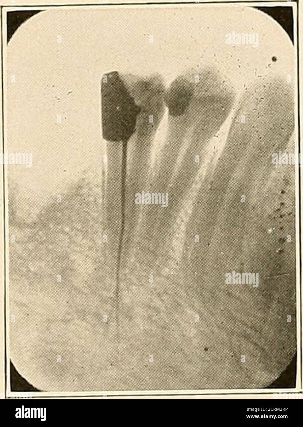 . Oral sepsis in its relationship to systemic disease . Fig. 166. Fig ...