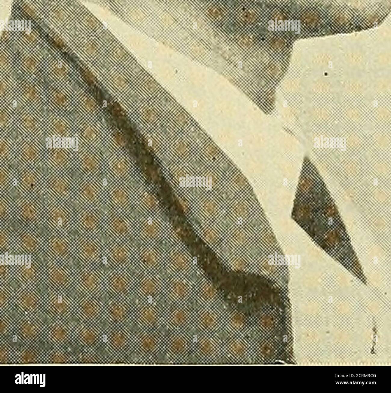 Tinea barbae hi-res stock photography and images - Alamy