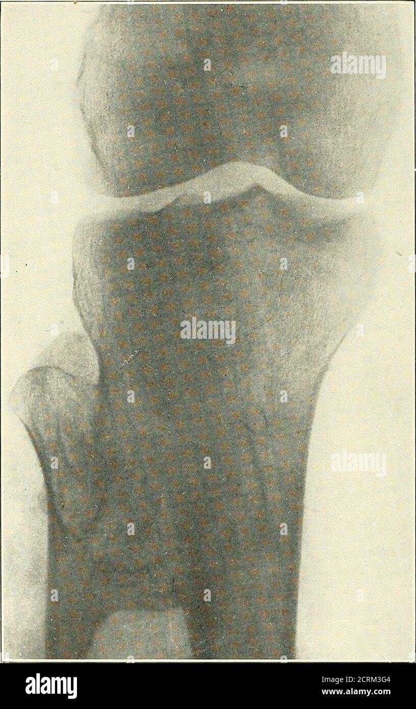 . Roentgen interpretation; a manual for students and practitioners ...
