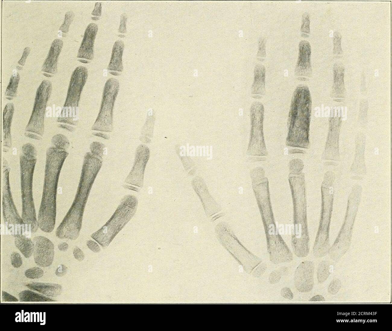 Trophic changes hi-res stock photography and images - Alamy