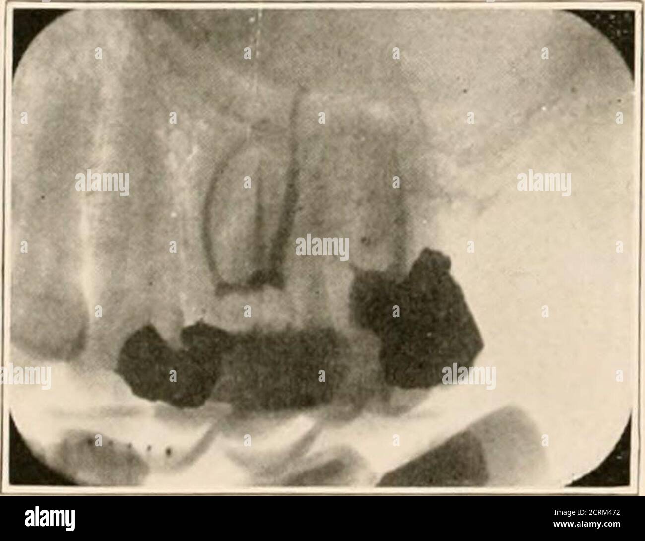 . Oral sepsis in its relationship to systemic disease . Fig. 153. Fig ...