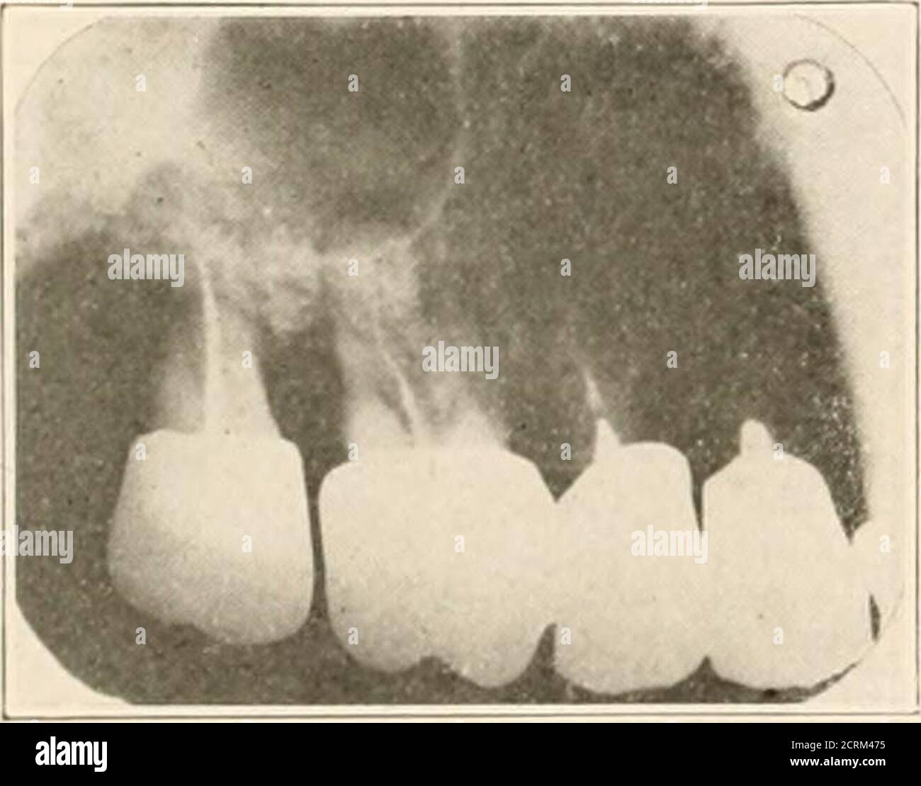 Bookidinte hi-res stock photography and images - Alamy