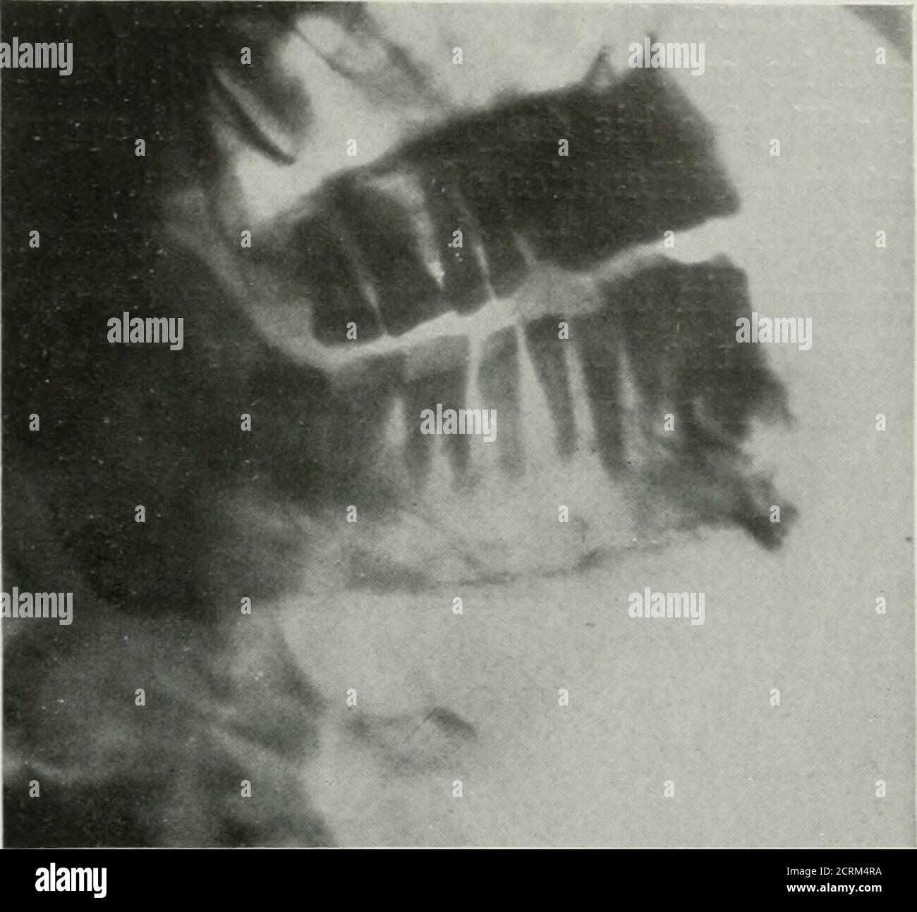 . The American journal of roentgenology, radium therapy and nuclear ...