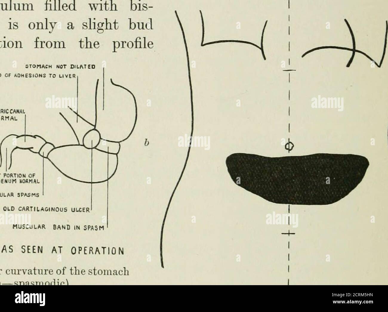 Spasm band hi-res stock photography and images - Alamy