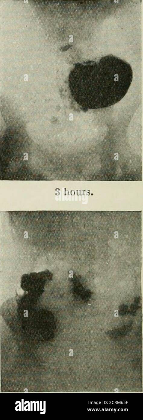 . Radiography and radio-therapeutics . .:> liours. 7 hours. 24 hours ...