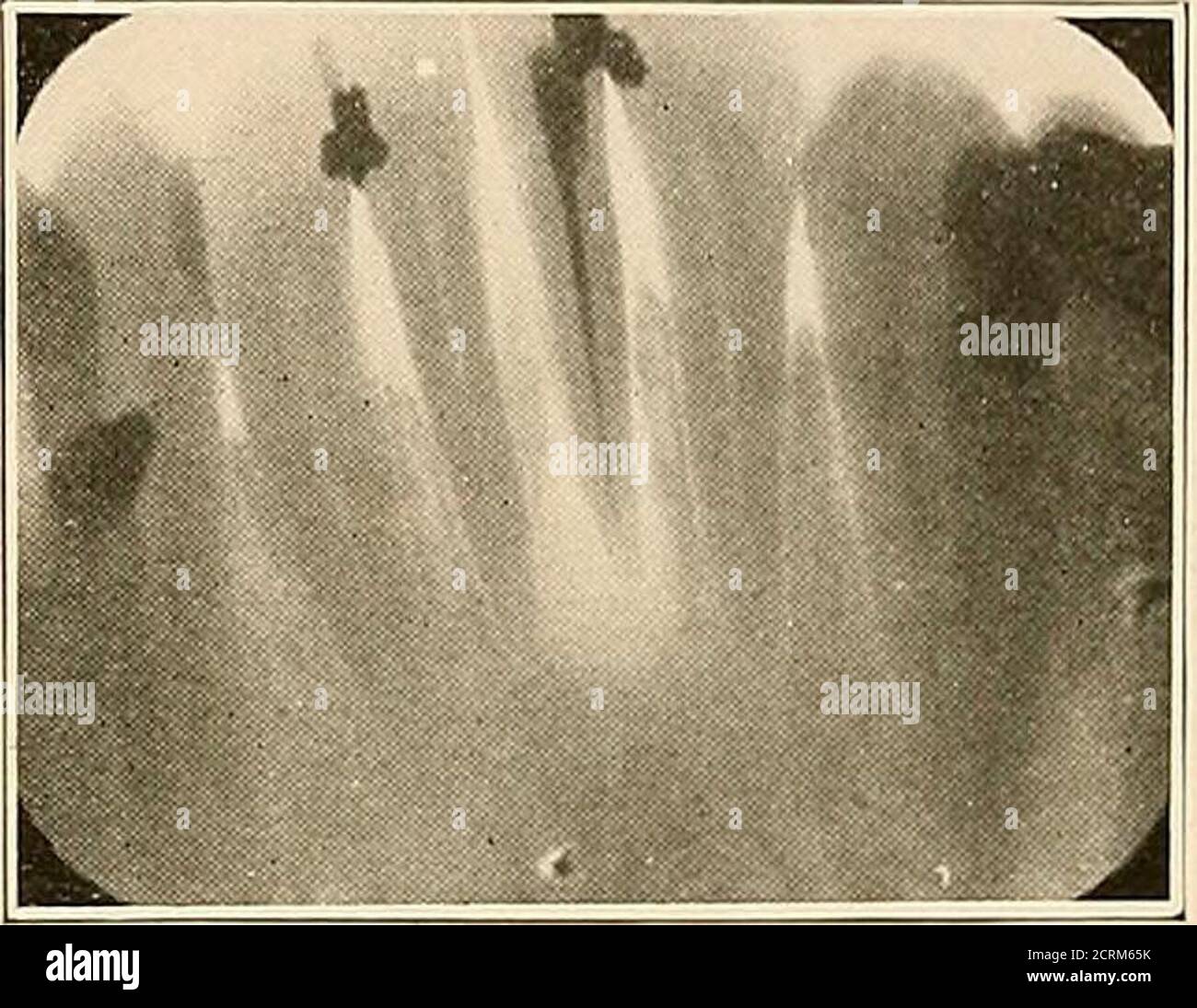 . Oral sepsis in its relationship to systemic disease . Fig. 140. Fig ...