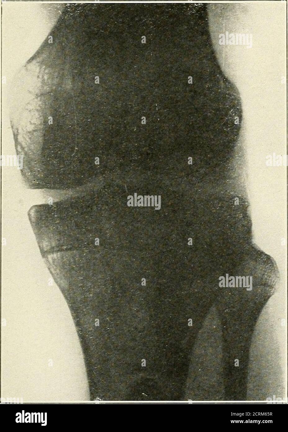 . Roentgen interpretation; a manual for students and practitioners ...