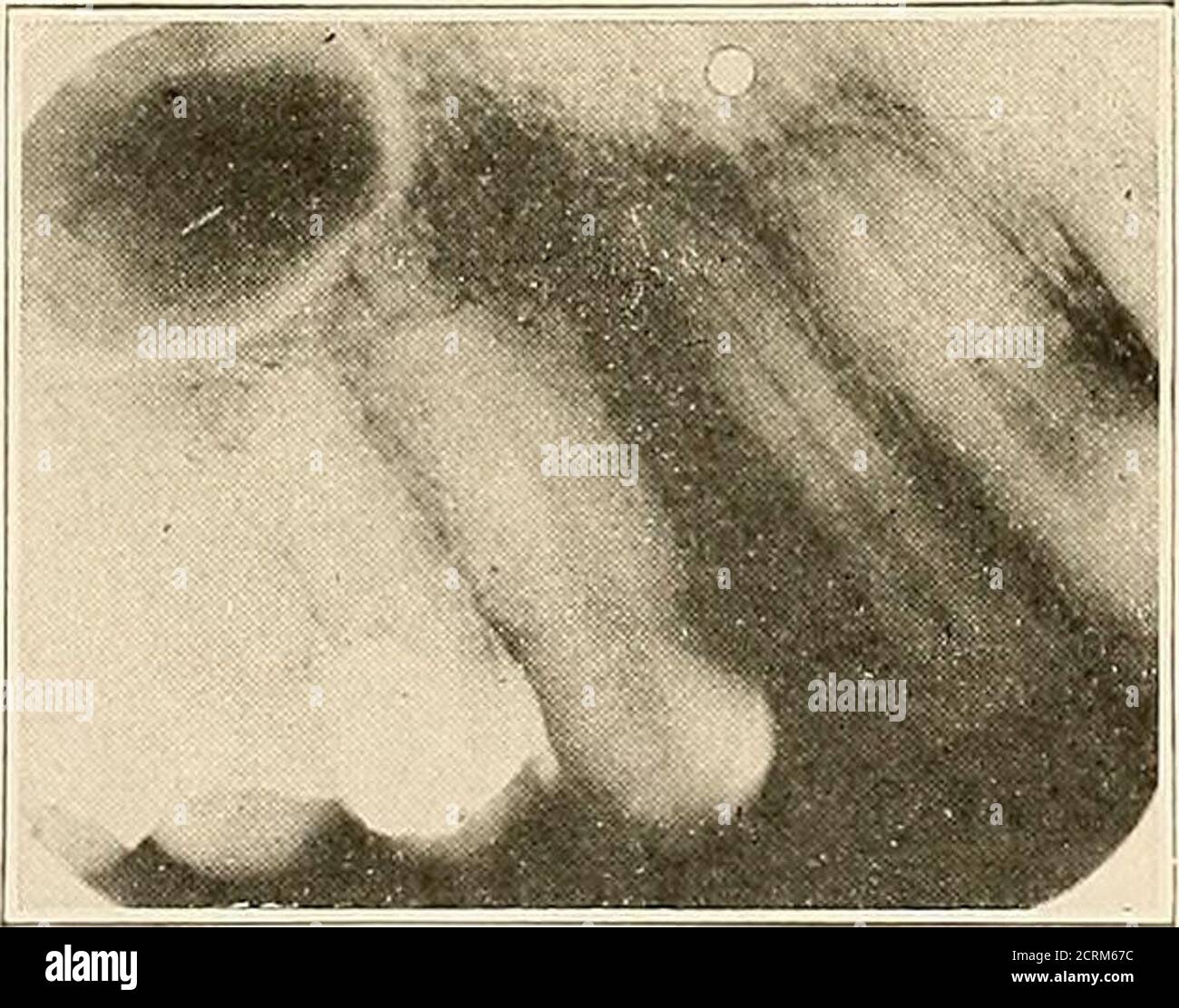 . Interpretation of dental & maxillary roentgenograms . Fig. 120. Fig ...
