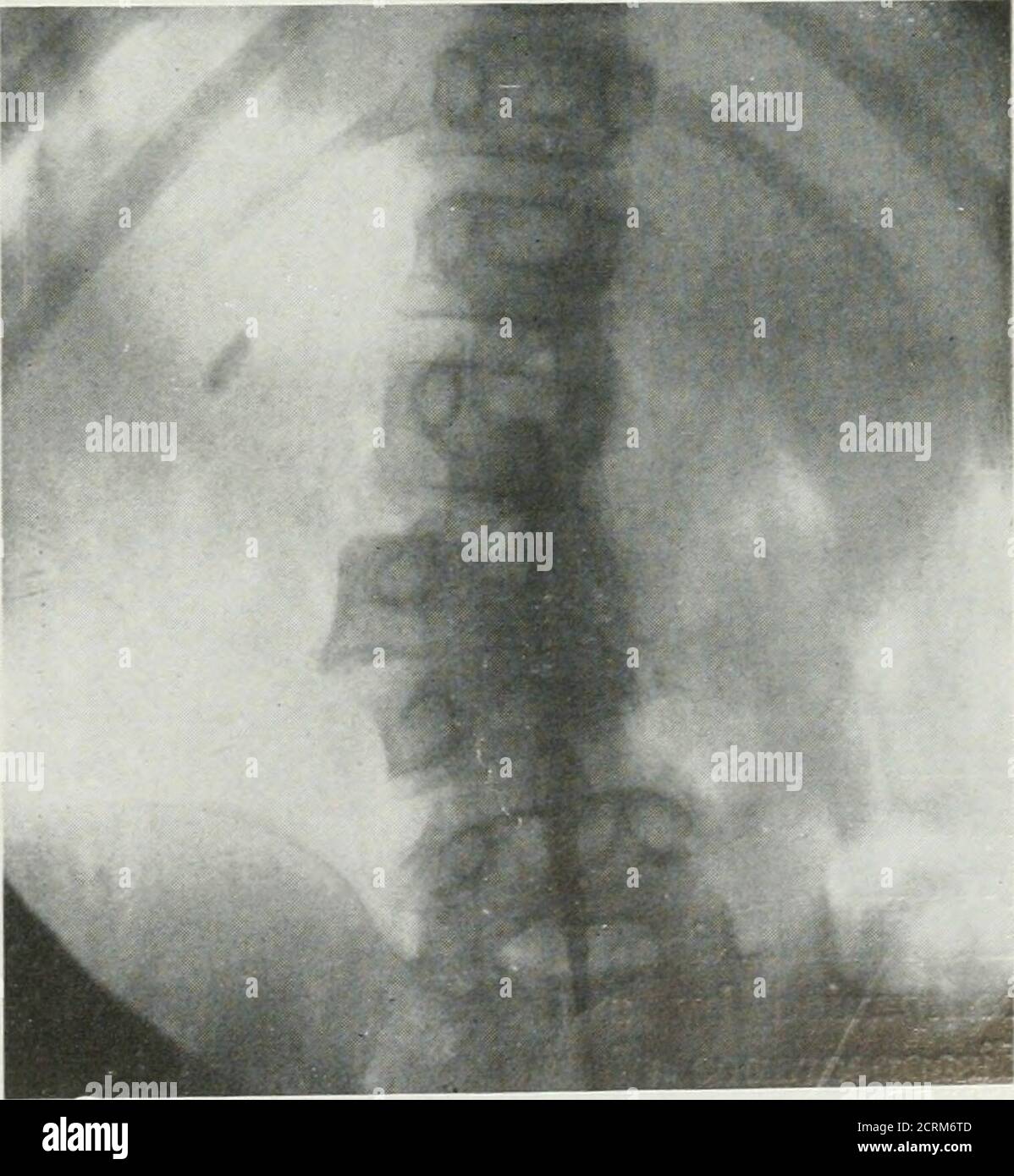 . The American journal of roentgenology, radium therapy and nuclear ...