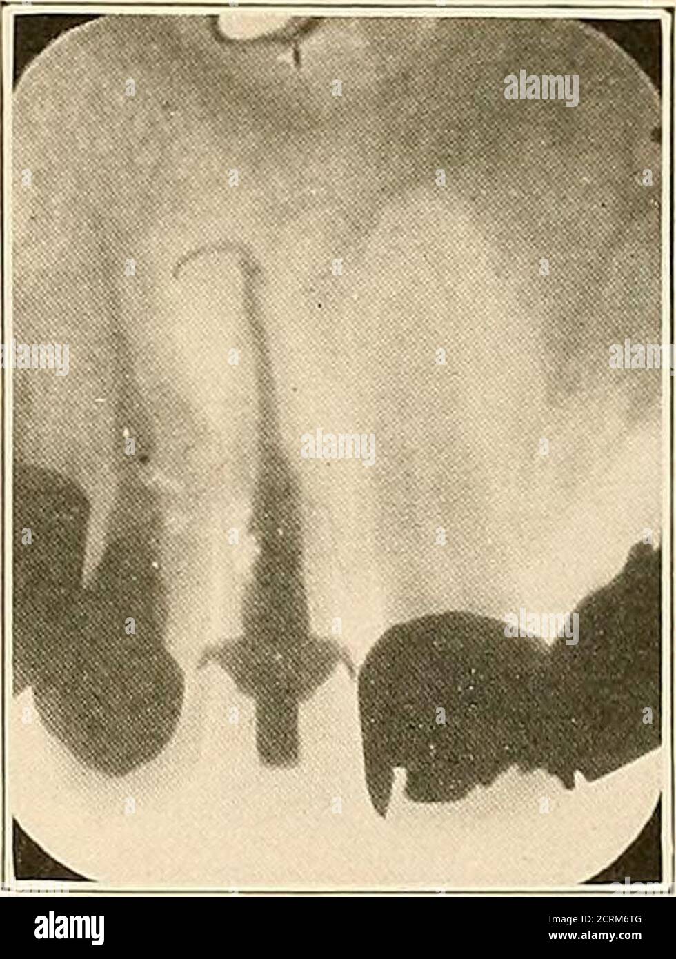 . Oral sepsis in its relationship to systemic disease . Fig. 132. Fig ...