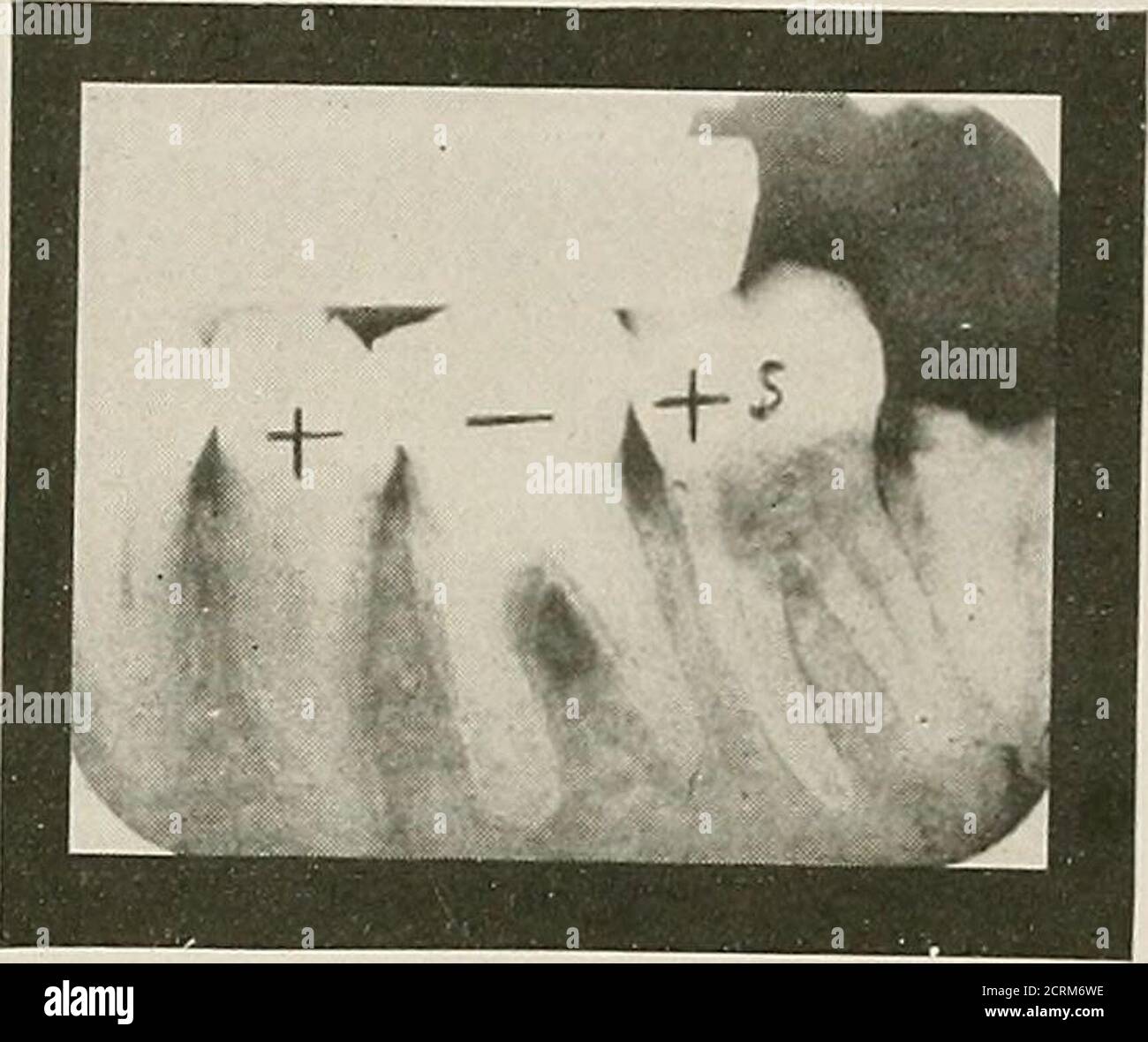 . Electro-radiographic diagnosis; a book on the electric test for pulp ...