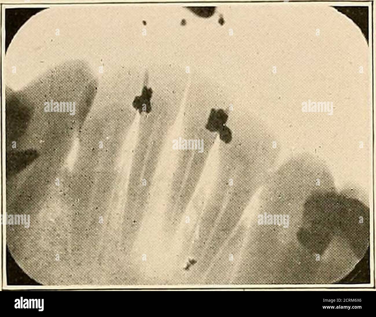 . Oral sepsis in its relationship to systemic disease . Fig. 137. Fig ...