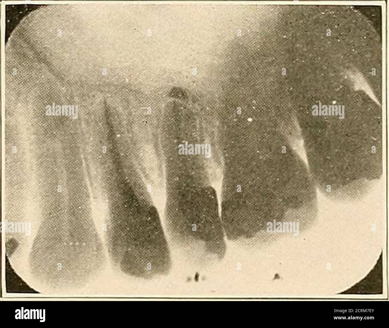 . Oral sepsis in its relationship to systemic disease . Fig. 127. Fig ...