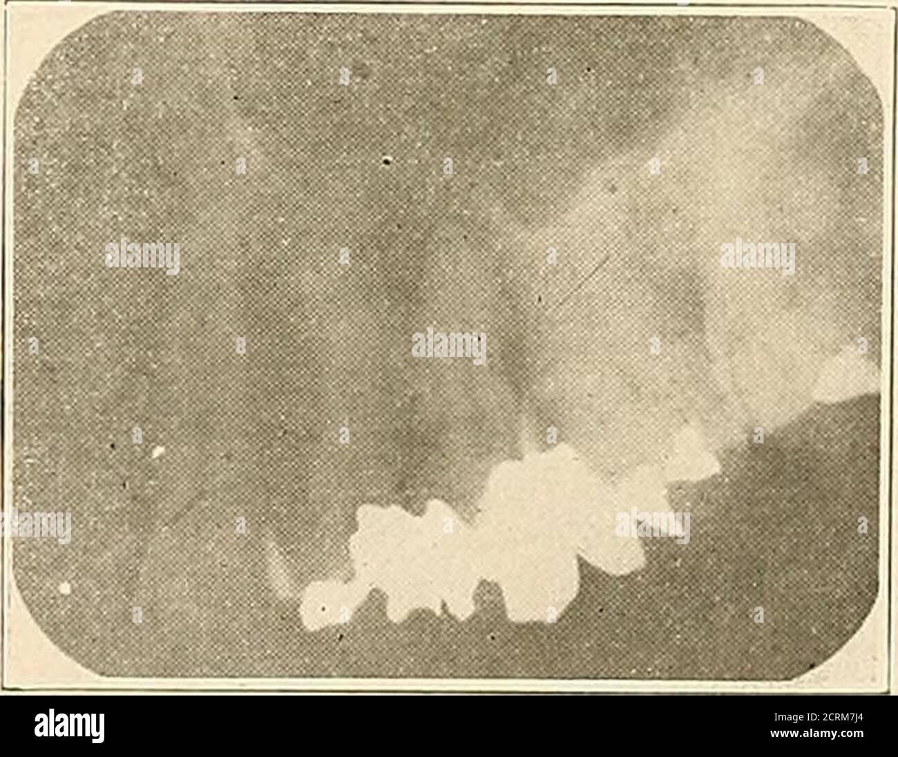 . Interpretation of dental & maxillary roentgenograms . Fig. 112. Fig ...