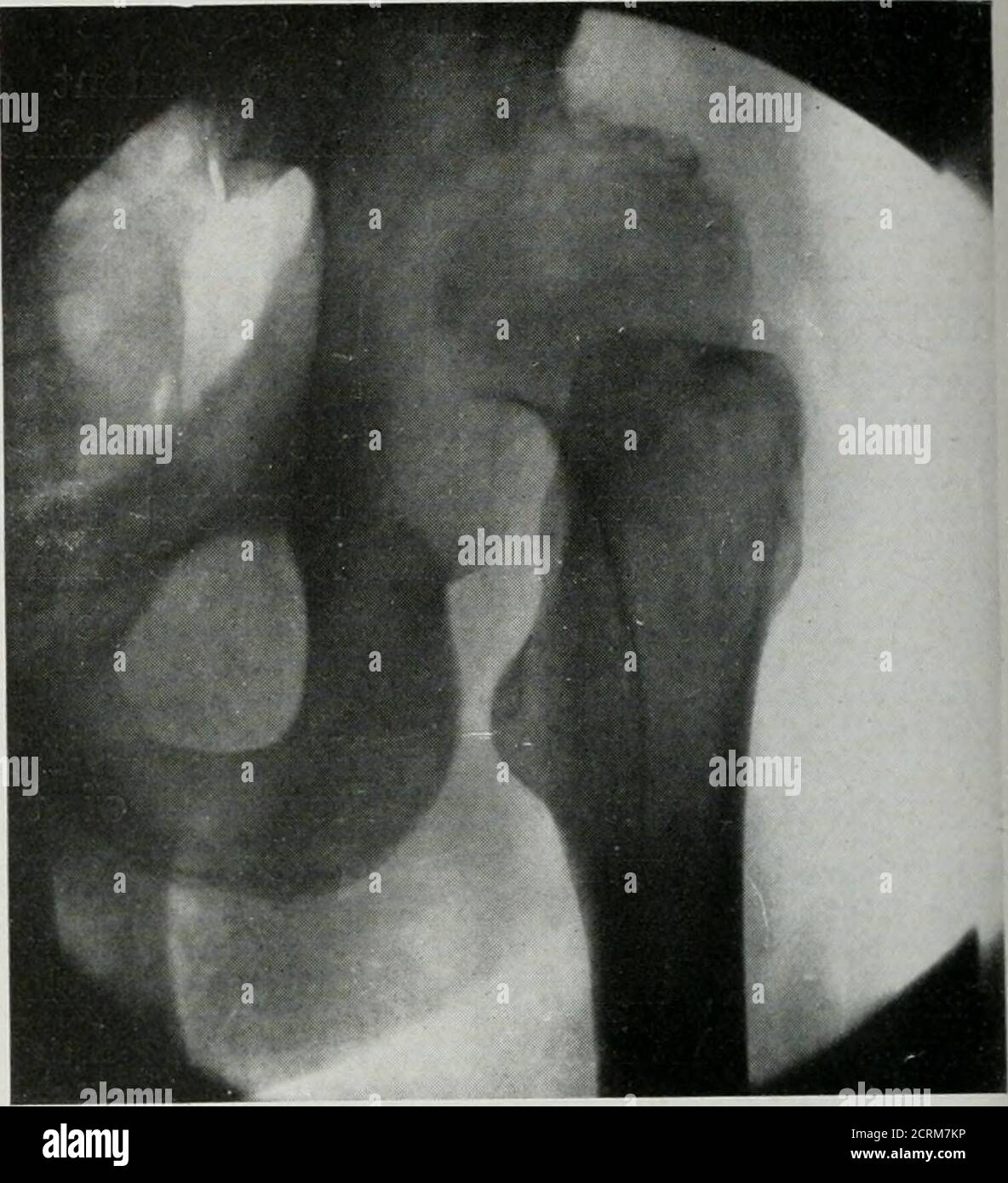 . The American journal of roentgenology, radium therapy and nuclear ...