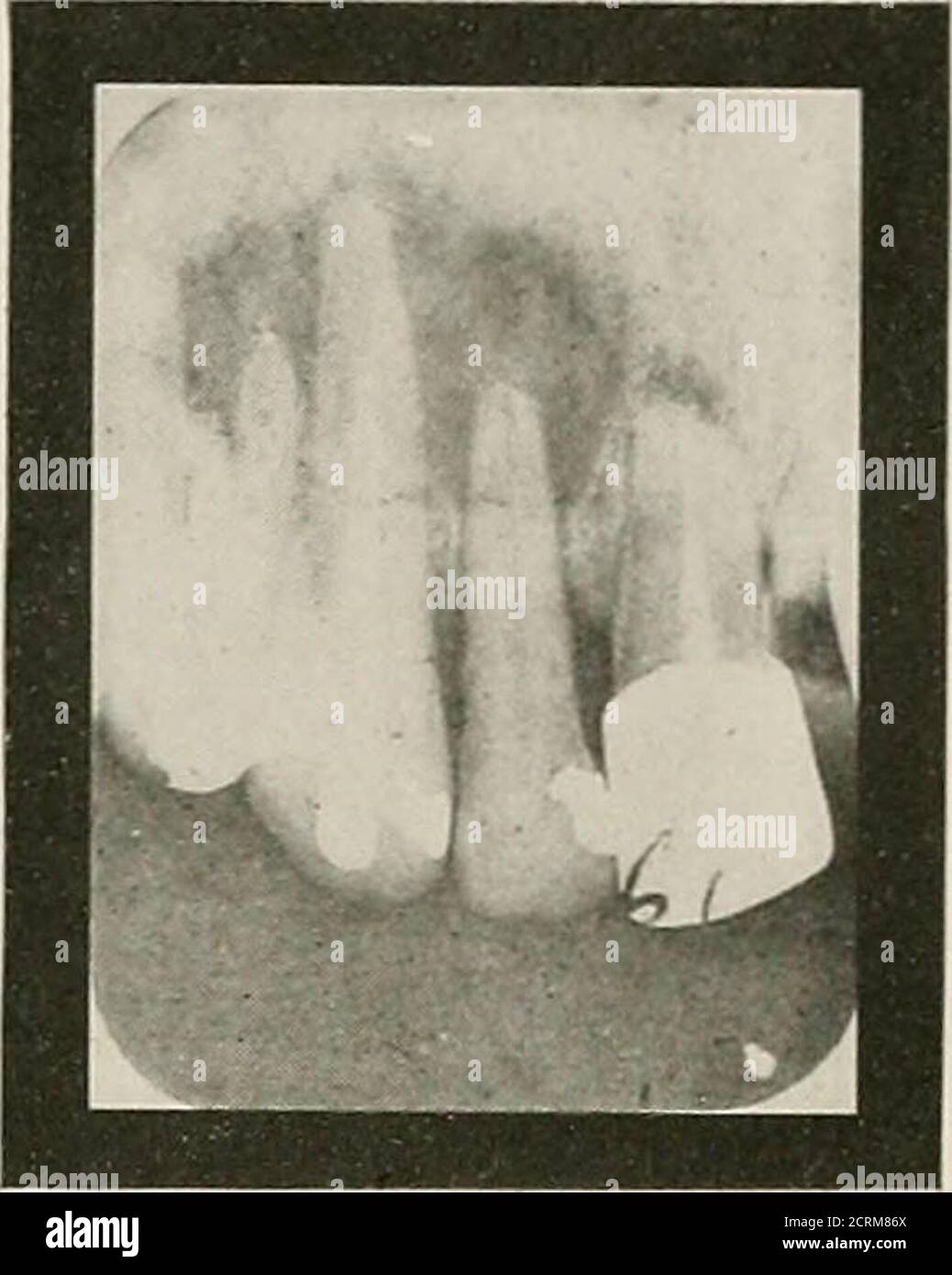 . Electro-radiographic diagnosis; a book on the electric test for pulp ...