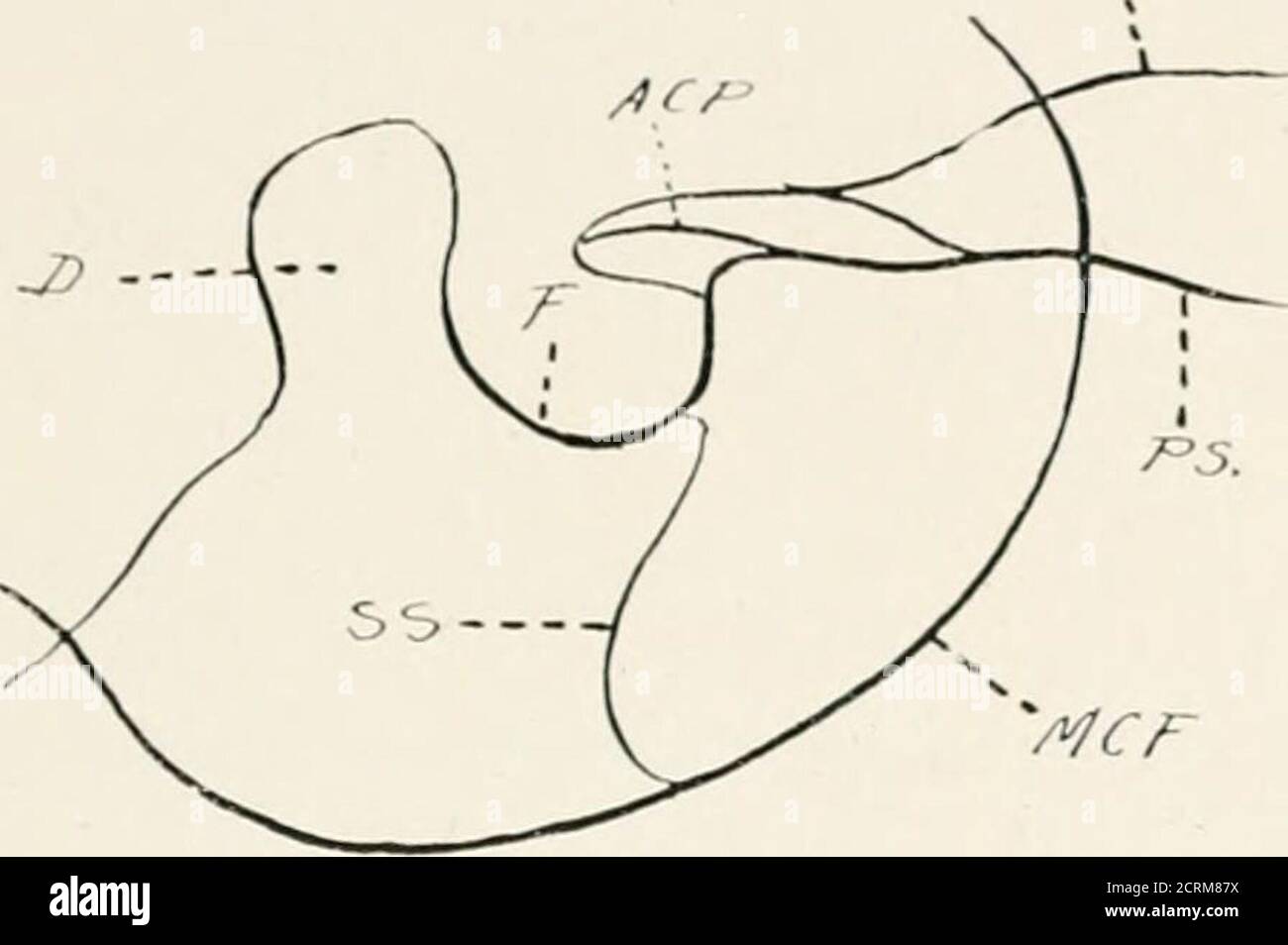 . Roentgen diagnosis of diseases of the head . AICF Fig. 35.—A type of ...
