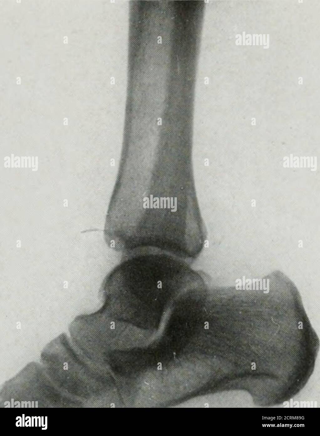 . The American journal of roentgenology, radium therapy and nuclear ...