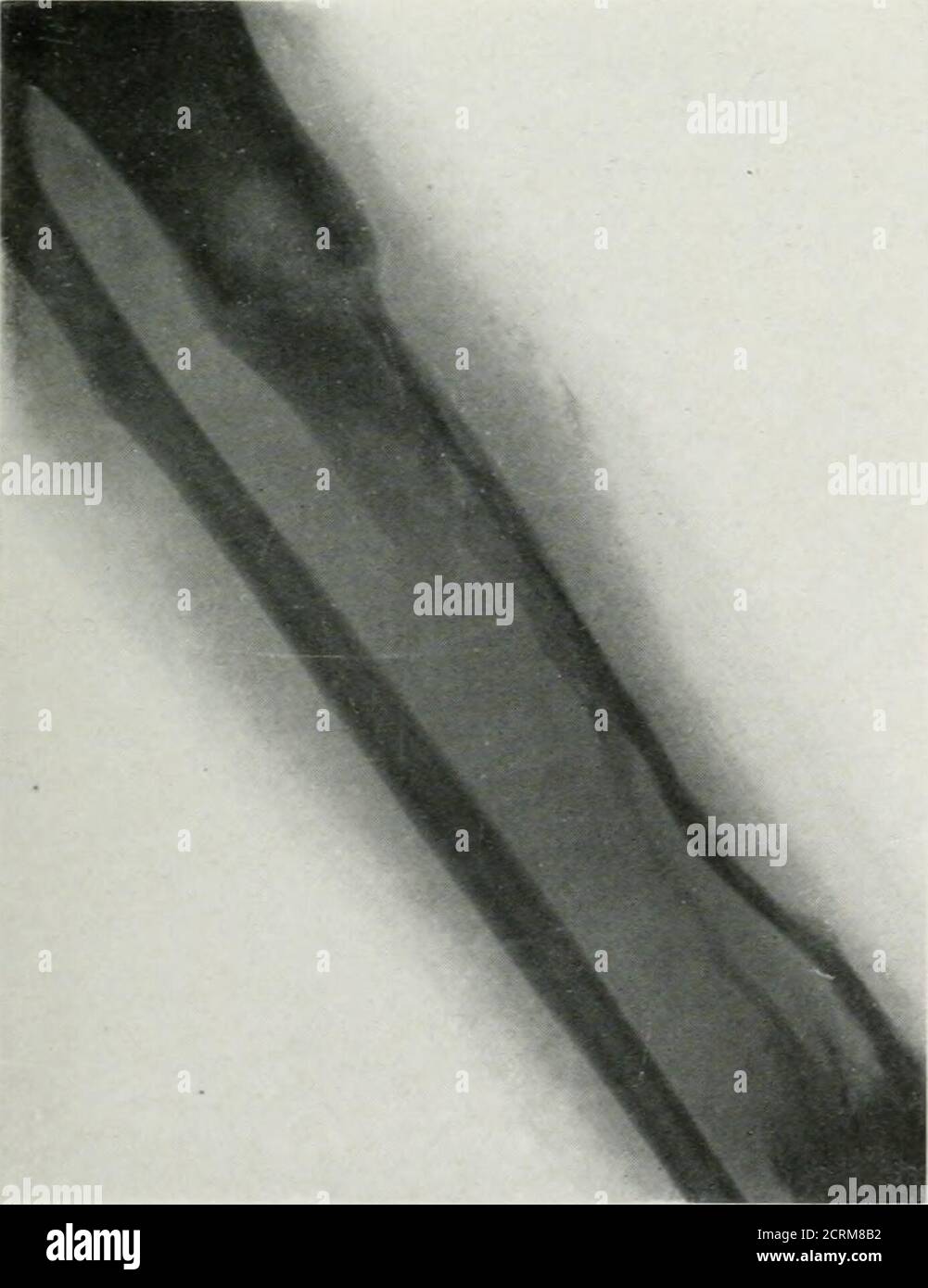 . The American journal of roentgenology, radium therapy and nuclear ...