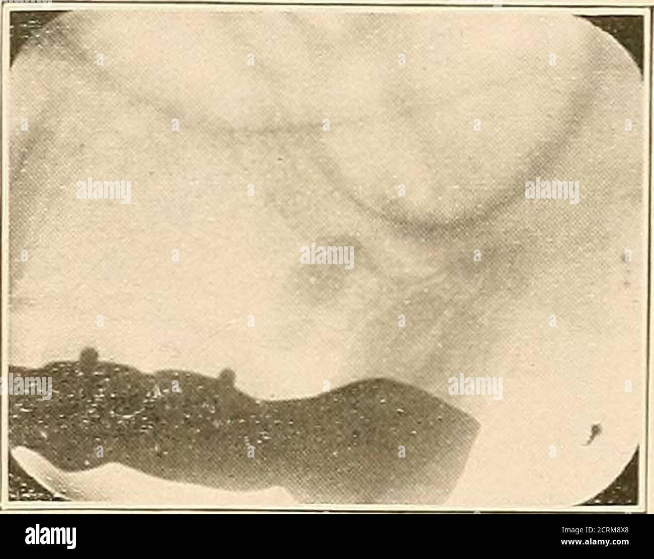 . Oral sepsis in its relationship to systemic disease . Fig. US. Fig ...