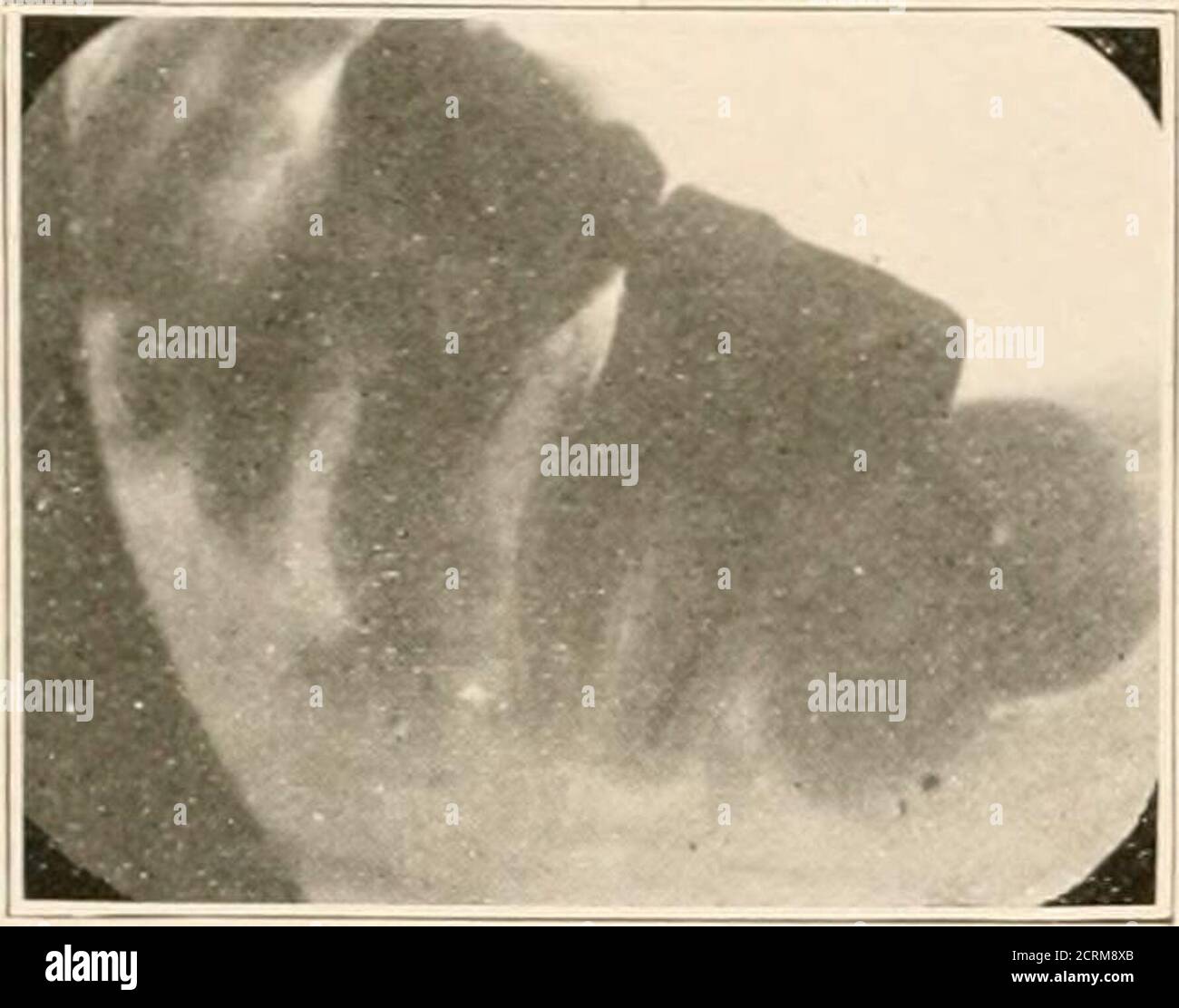 . Oral sepsis in its relationship to systemic disease . Fig. 113. Figs ...
