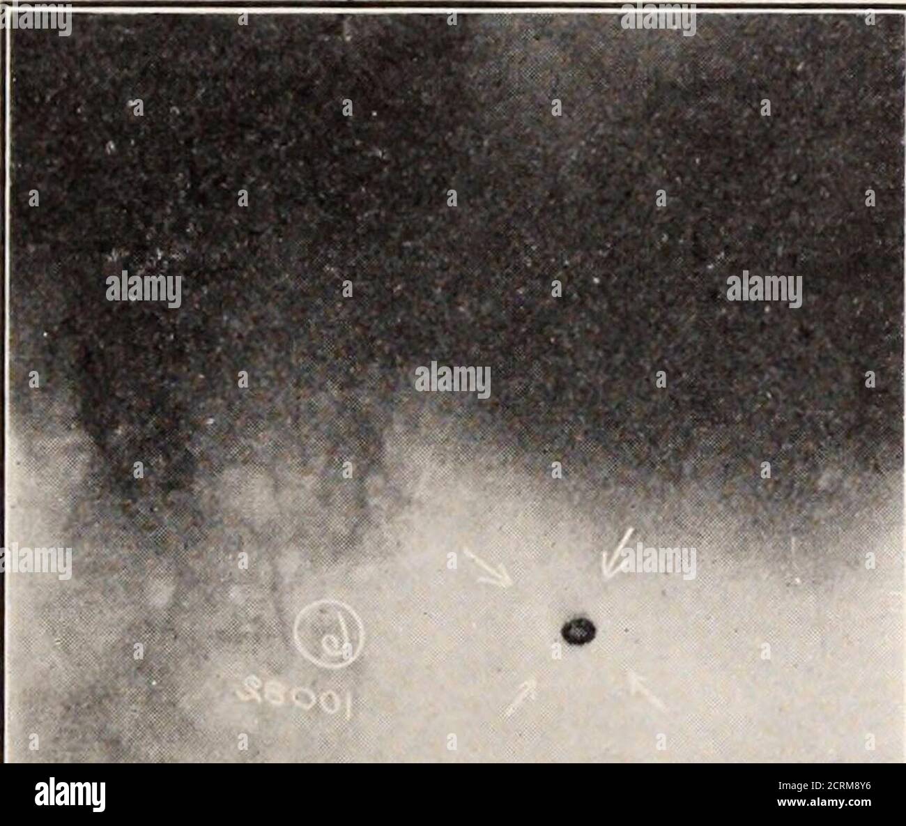 Ulnar deviation hi-res stock photography and images - Alamy