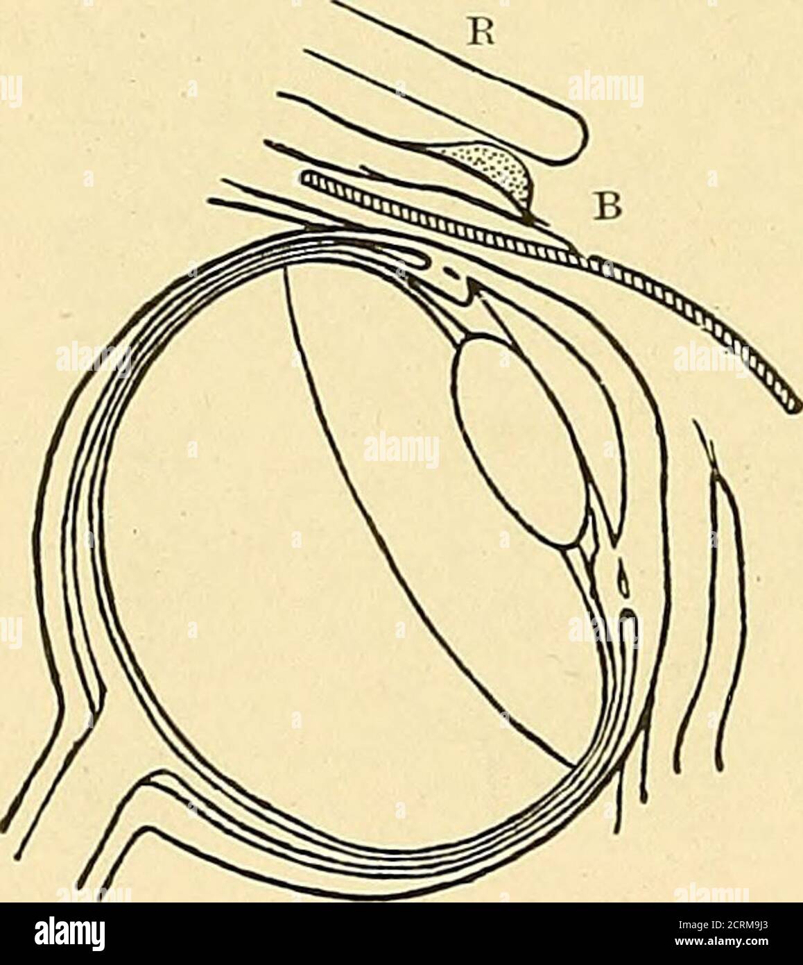 Rodent ulcers hi-res stock photography and images - Alamy
