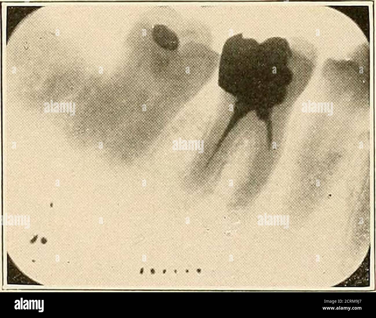 . Oral sepsis in its relationship to systemic disease . .... Fig. 111 ...