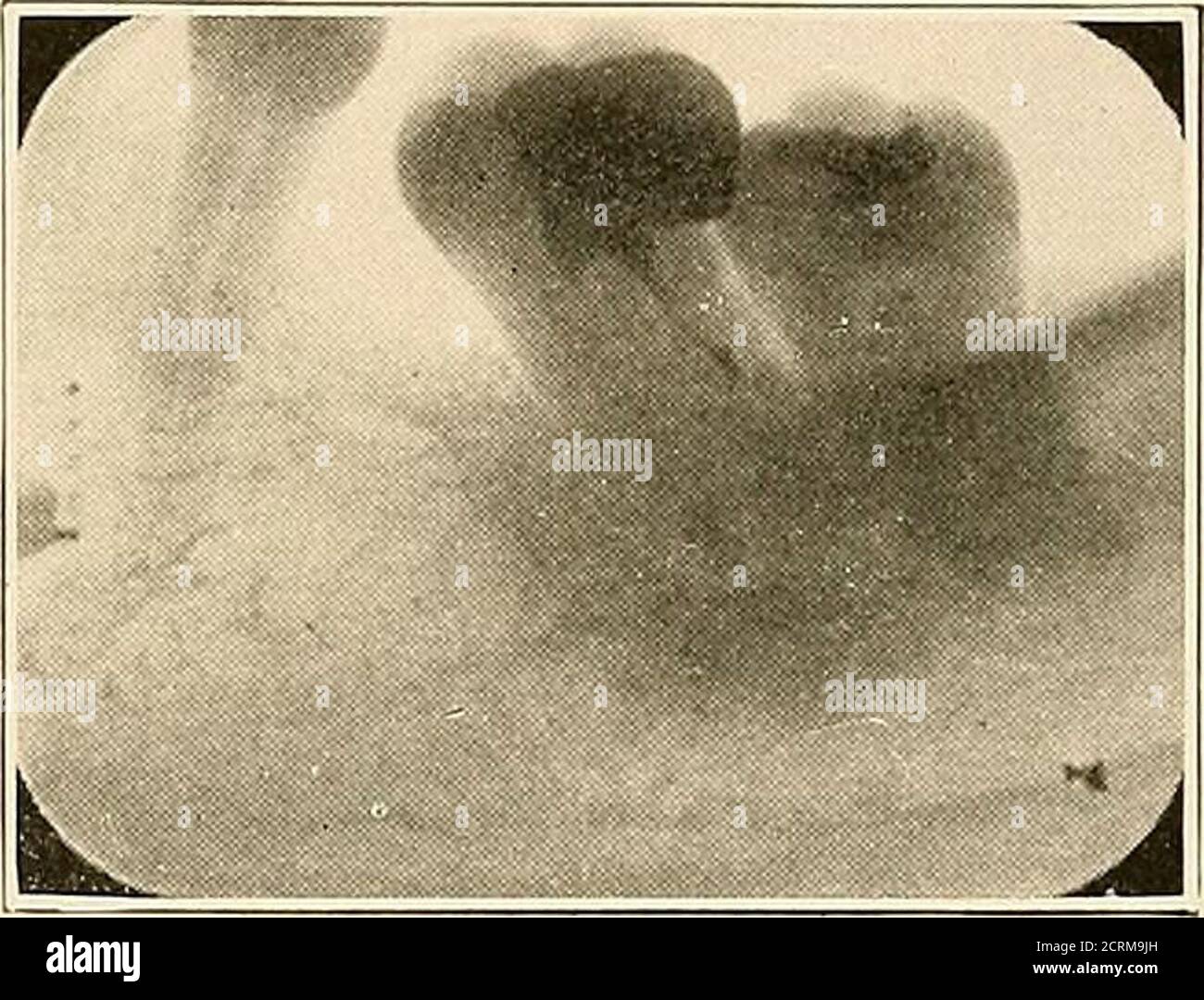. Oral sepsis in its relationship to systemic disease . Fig. 109. Fig ...