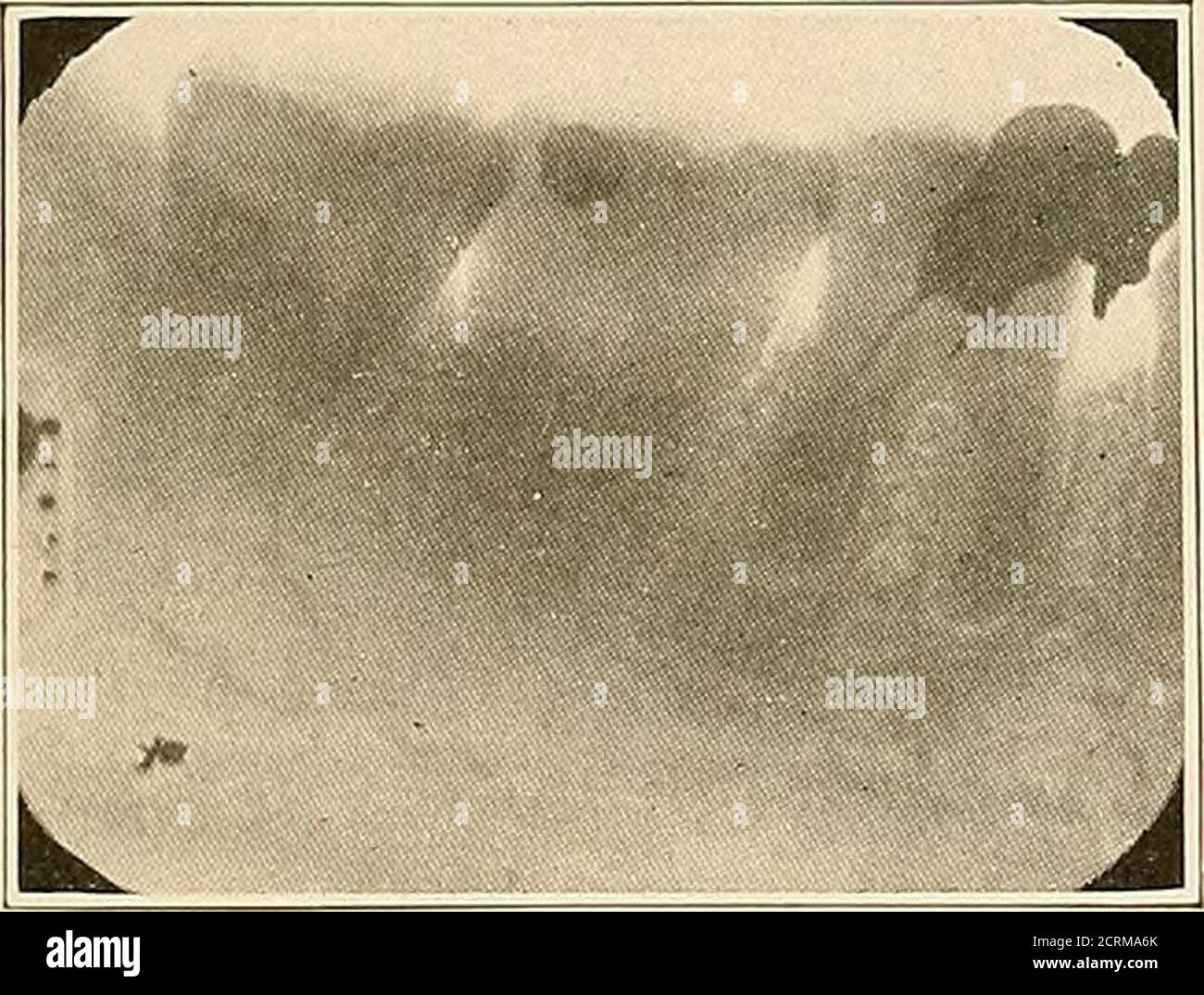 . Oral sepsis in its relationship to systemic disease . Fig. 107. Fig ...