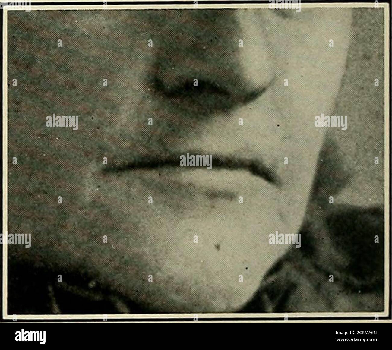 . Radiotherapy and phototherapy : including radium and high-frequency ...