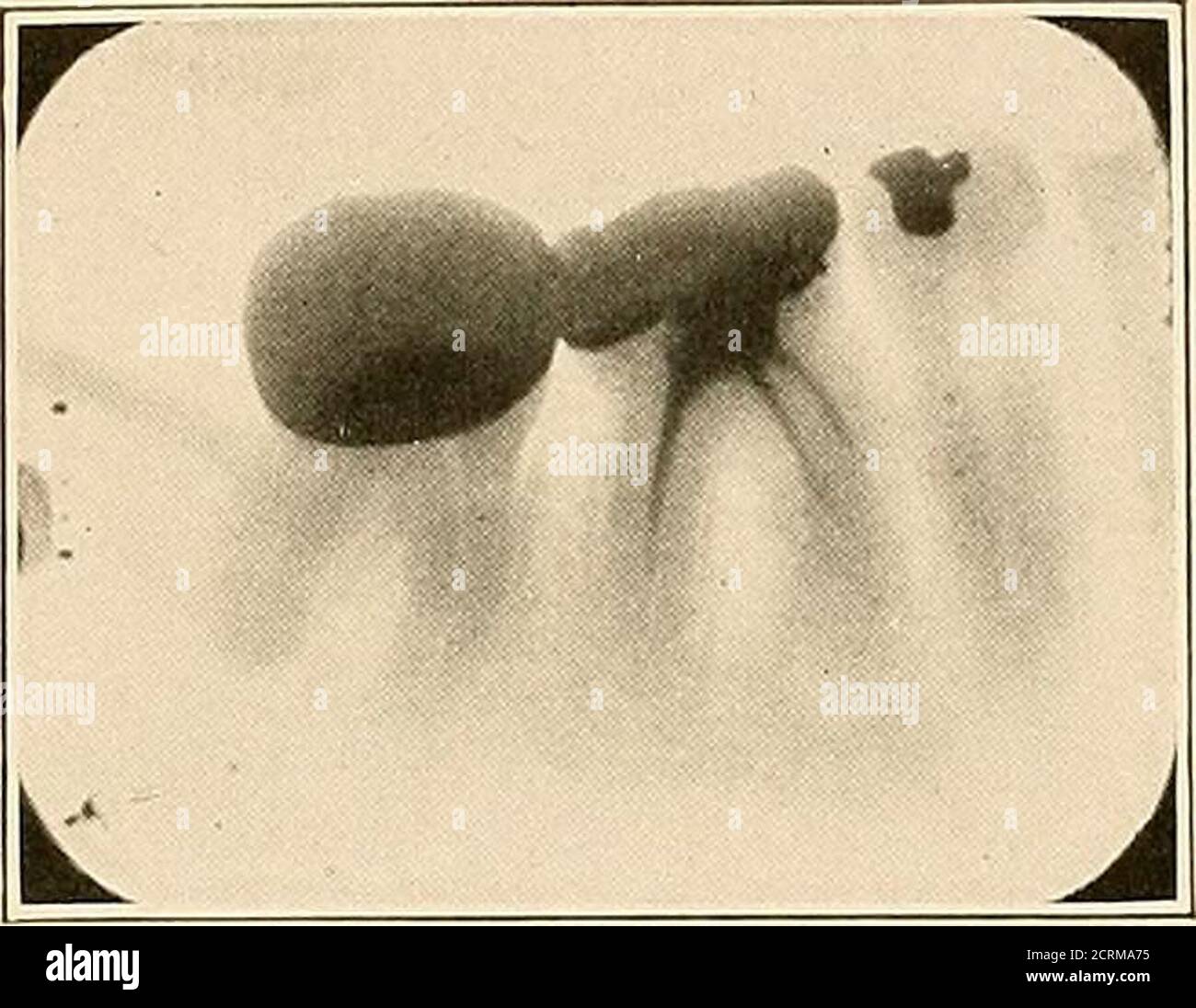 . Oral sepsis in its relationship to systemic disease . Fig. 107. Fig ...