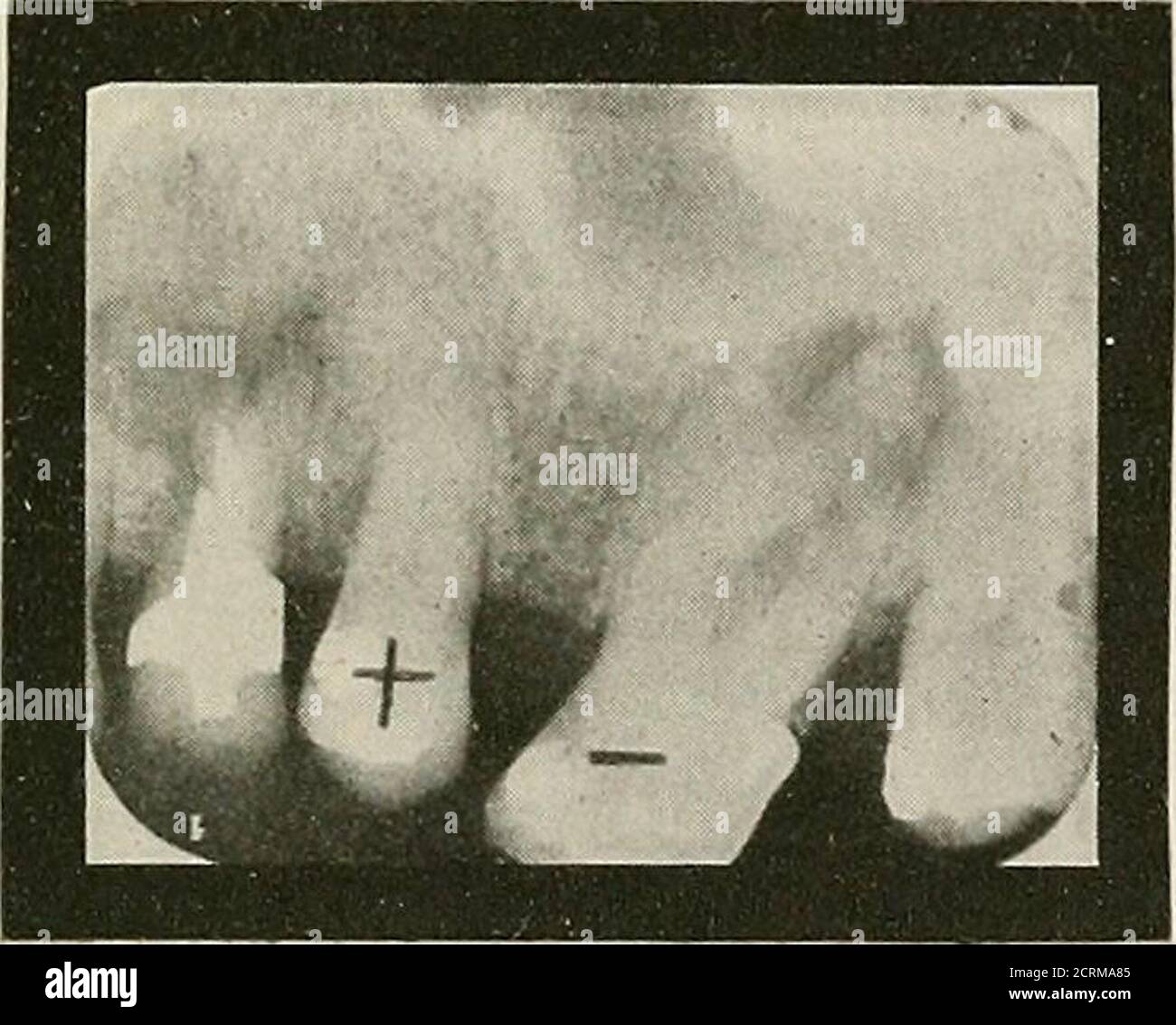 Radiographic detail hi-res stock photography and images - Alamy