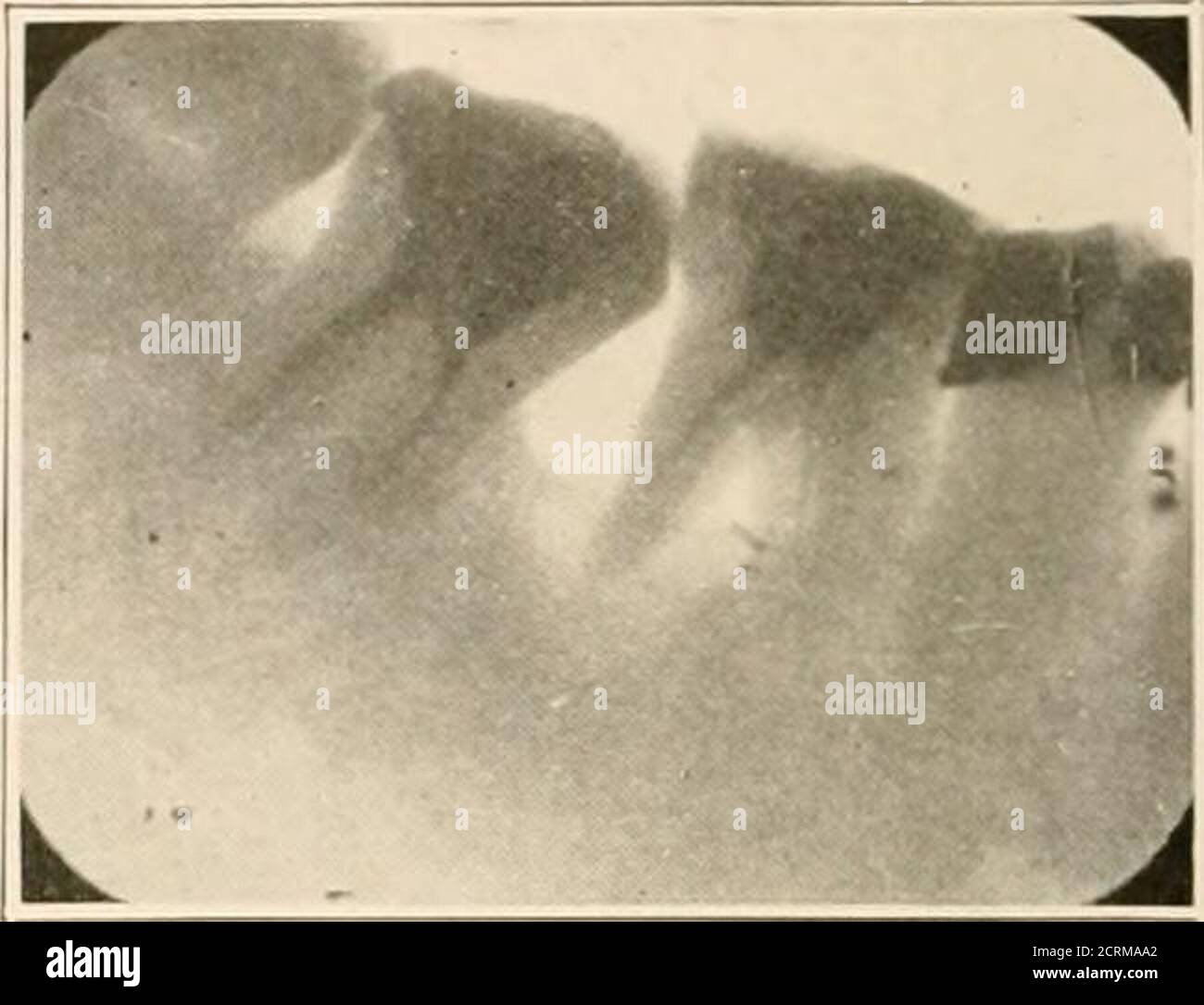 . Oral sepsis in its relationship to systemic disease . Fig. 102 Fig ...