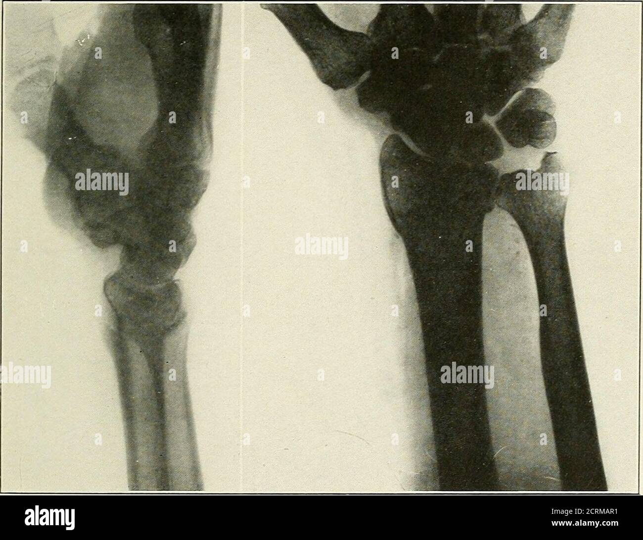 . Roentgen interpretation; a manual for students and practitioners ...