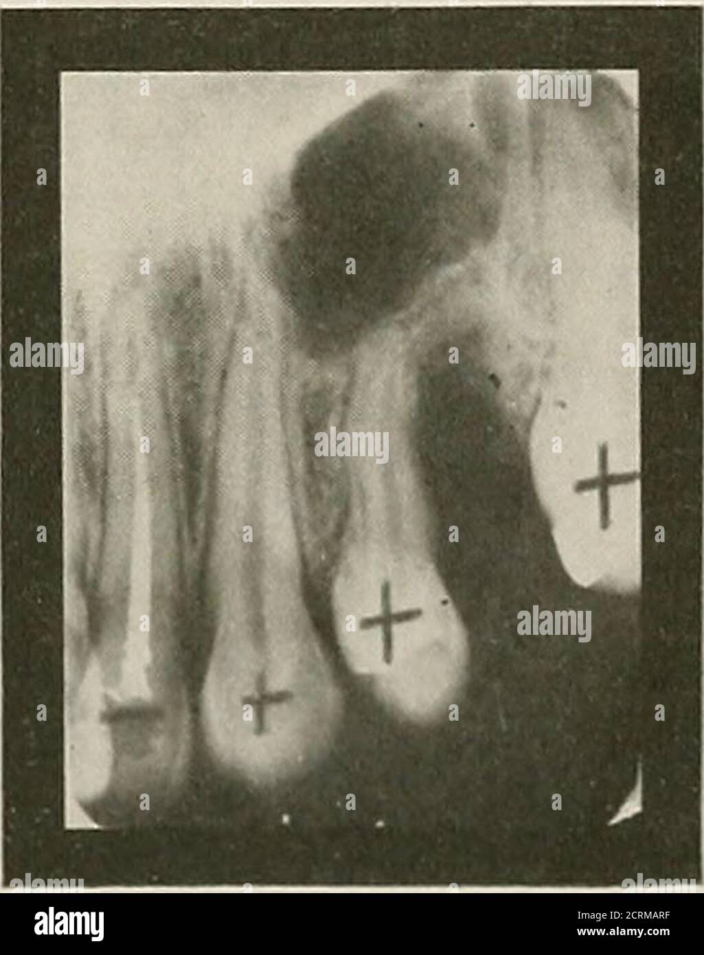 Canine eminence hi-res stock photography and images - Alamy