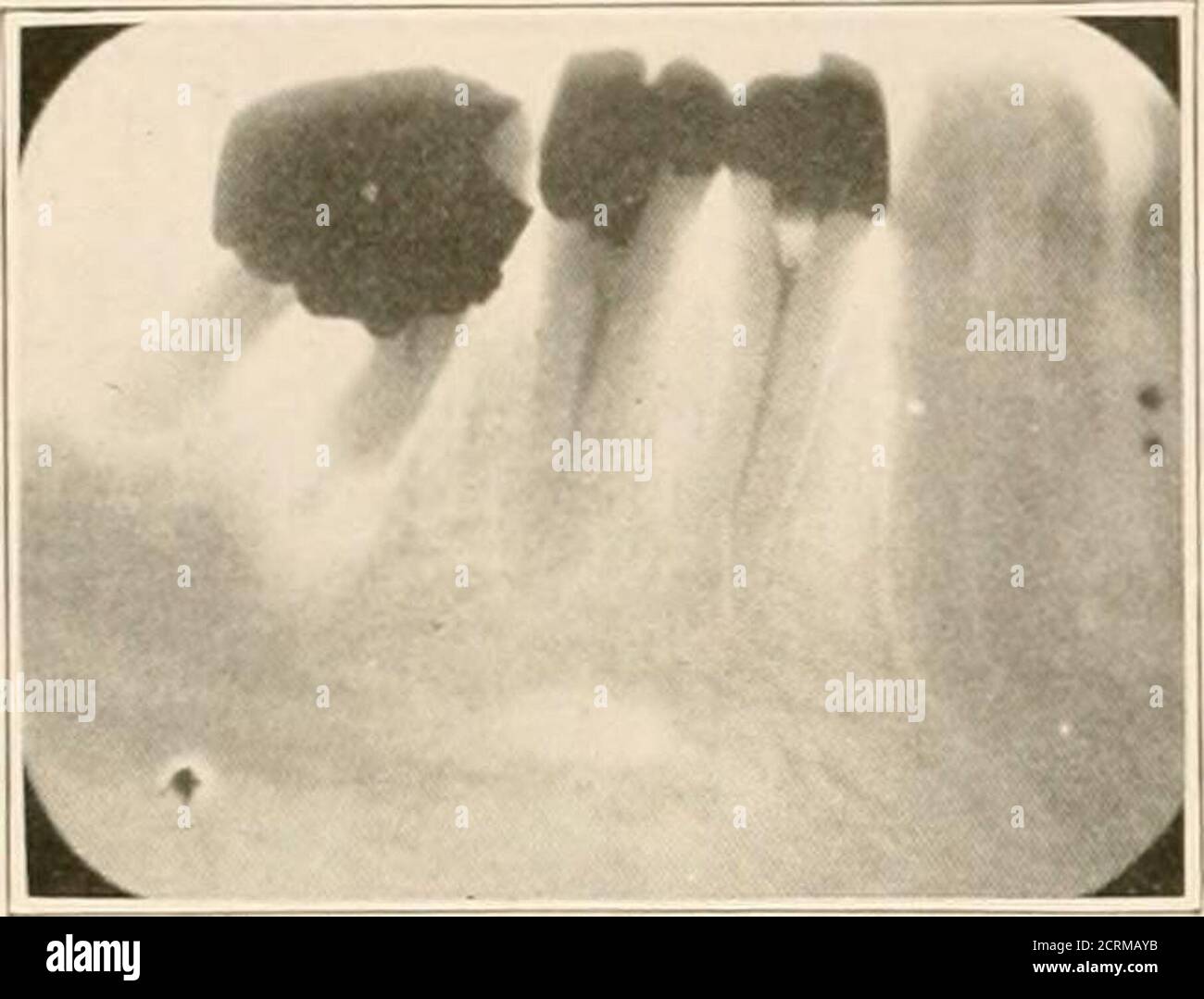 . Oral sepsis in its relationship to systemic disease . Fig. 102. Figs ...