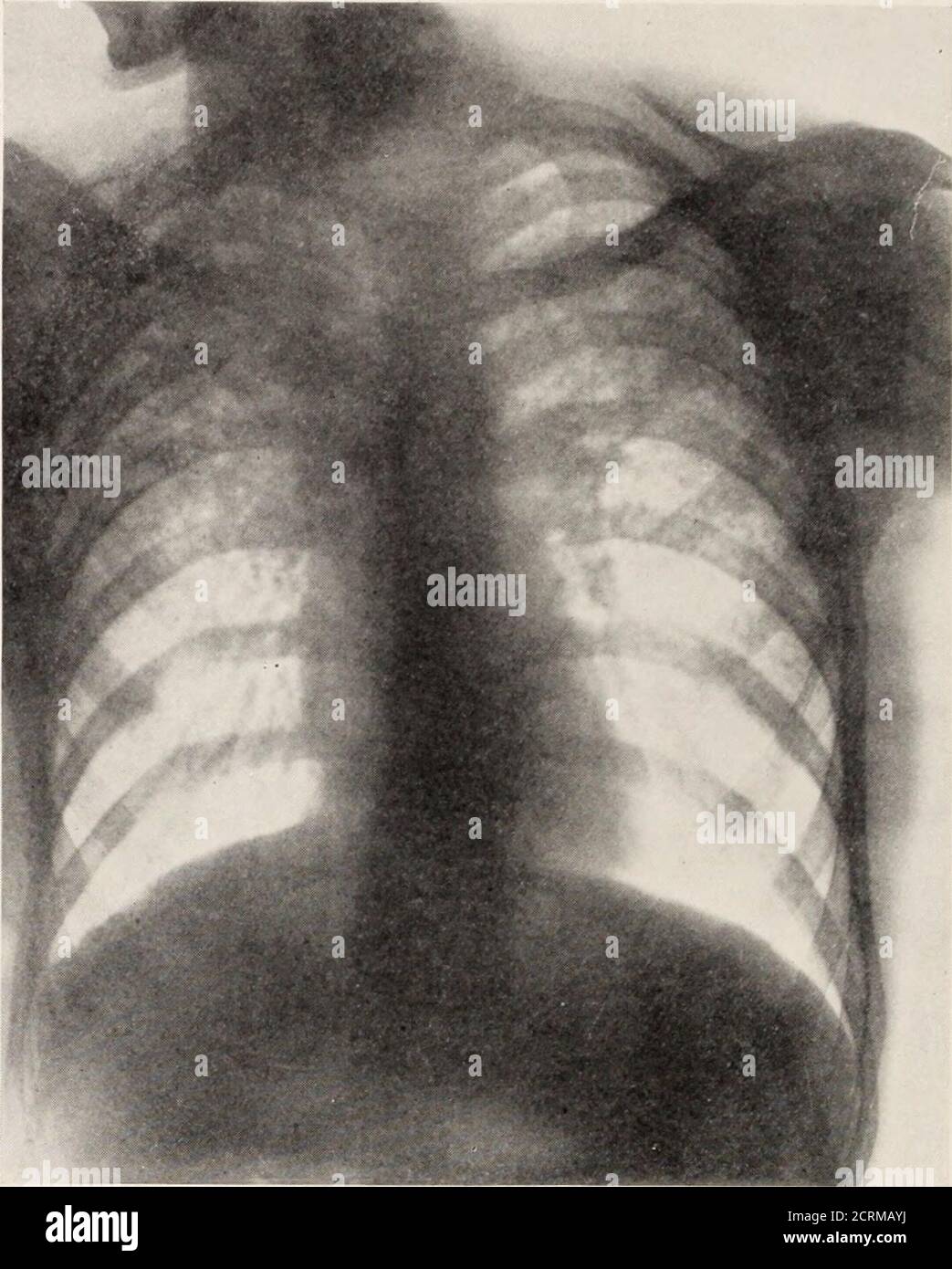 . Journal of roentgenology . No. 8352 Post mortem pathological ...