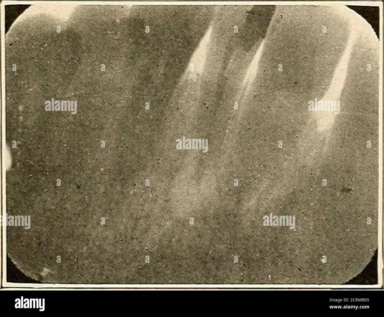 . Oral sepsis in its relationship to systemic disease . Fig. 100. Fig ...