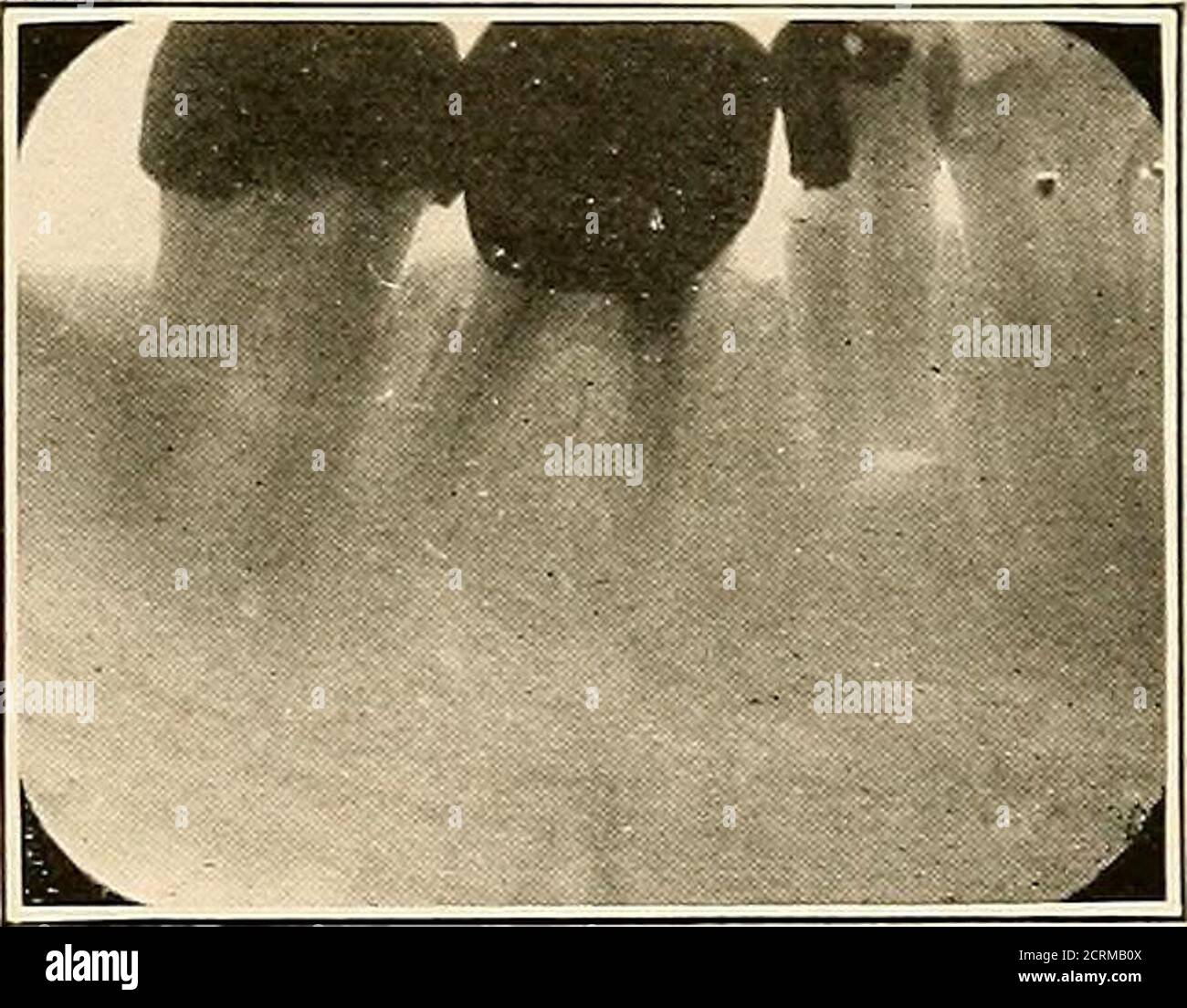 . Oral sepsis in its relationship to systemic disease . Fig. 100. Fig ...