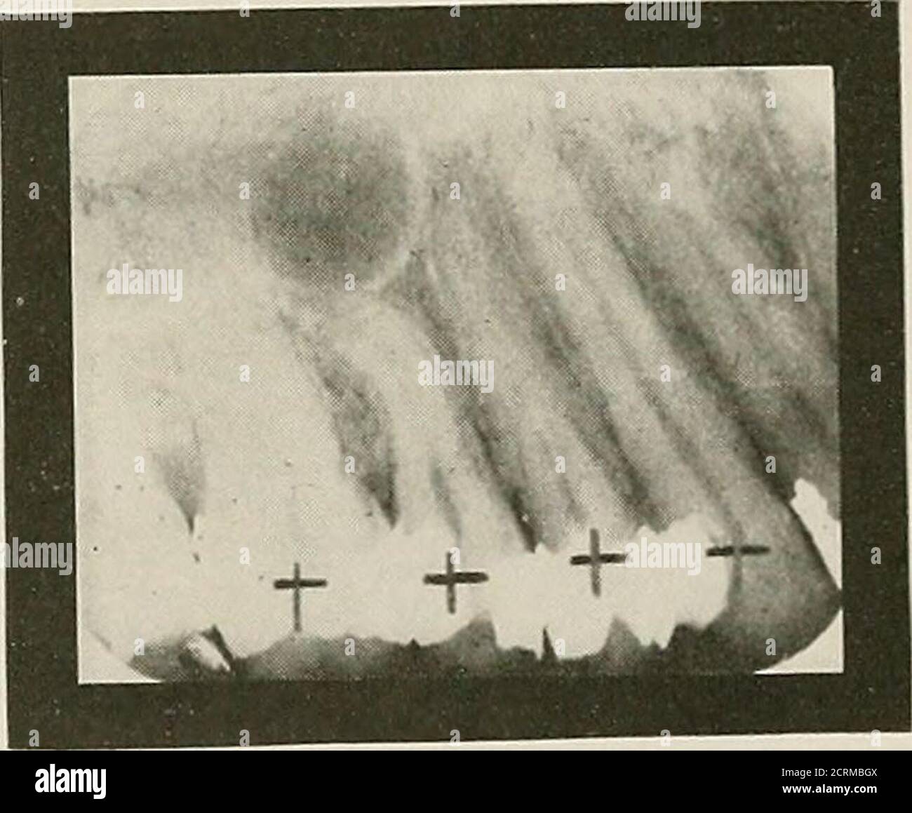. Electro-radiographic diagnosis; a book on the electric test for pulp ...