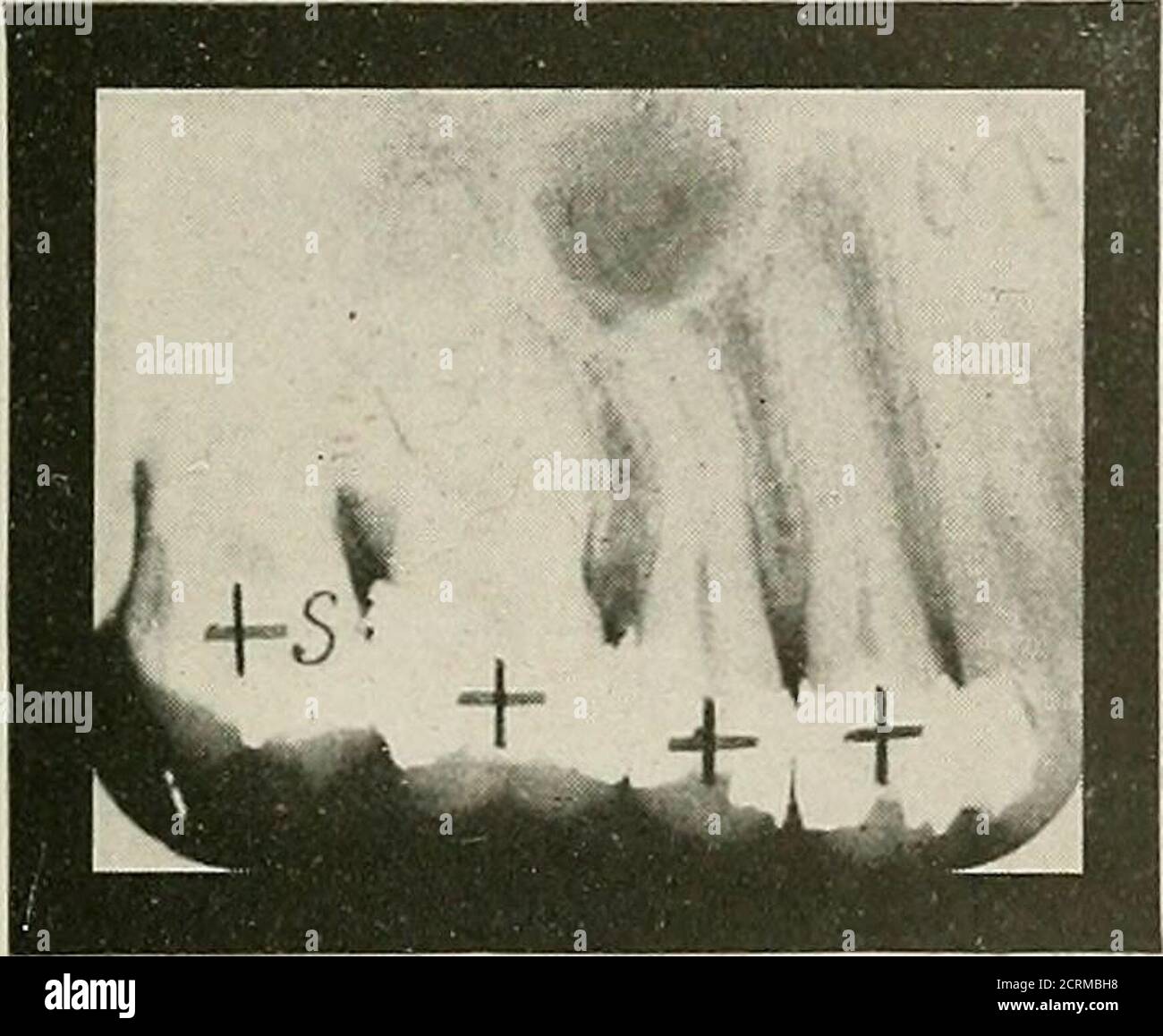 . Electro-radiographic diagnosis; a book on the electric test for pulp ...